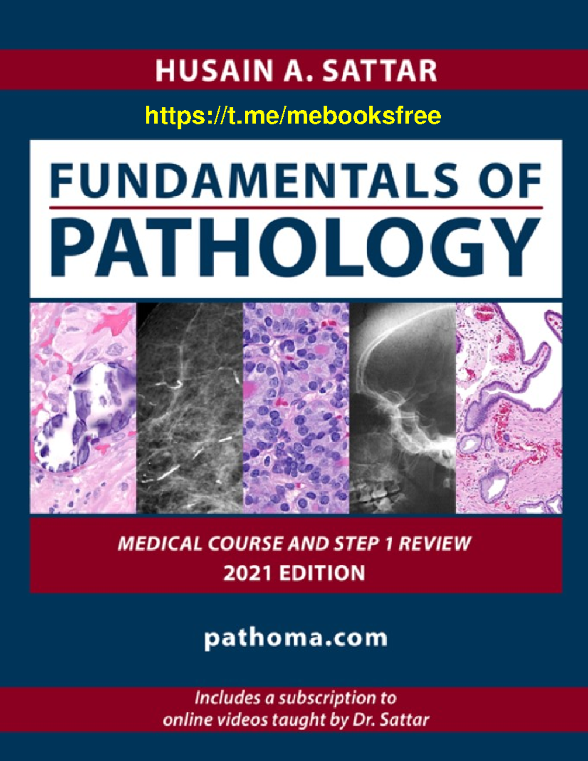 Sattar Husain A. - Fundamentals of Pathology Medical Course and Step 1 ...