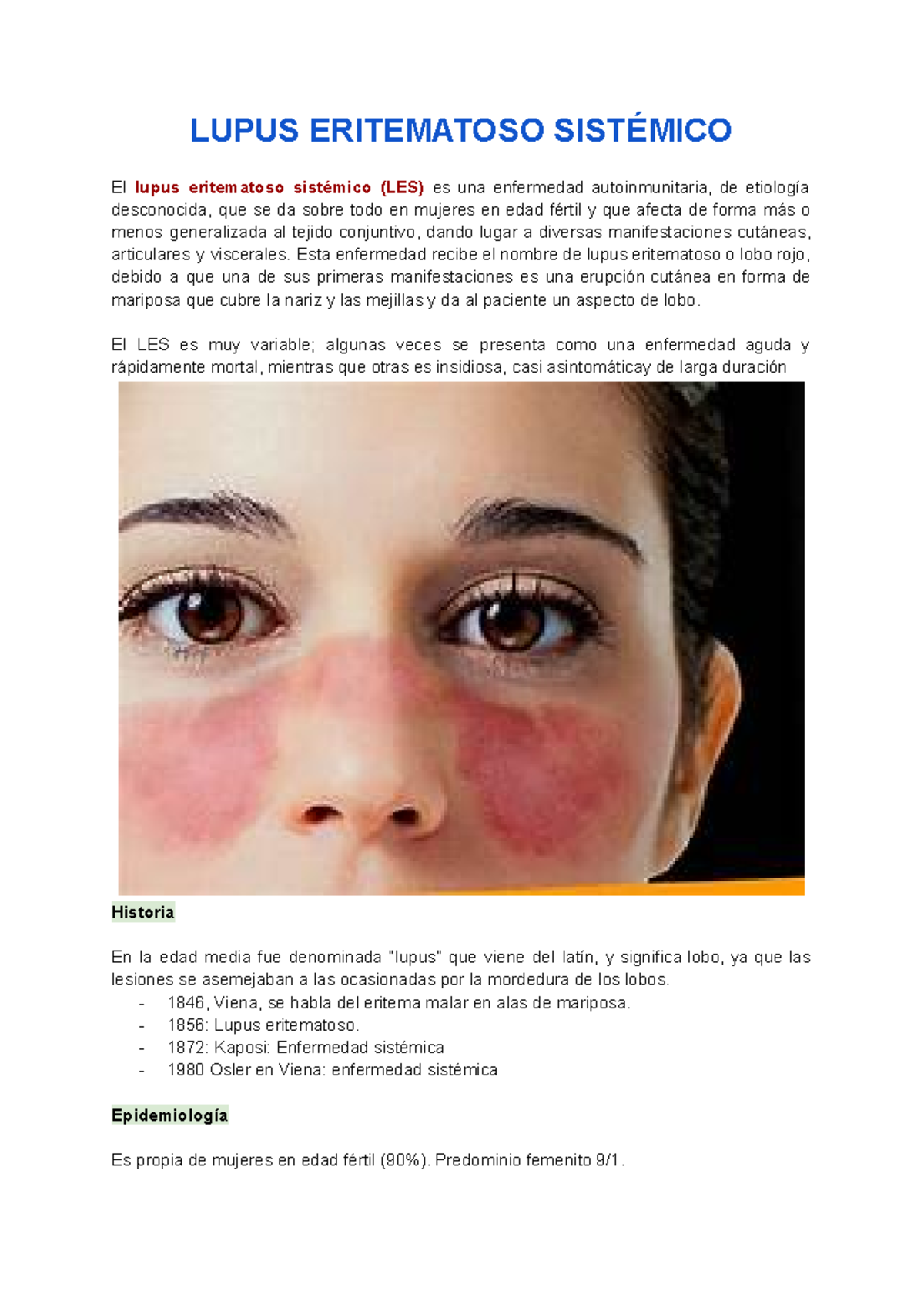 Lupus Eritematoso Sistémico - LUPUS ERITEMATOSO SISTÉMICO El lupus ...