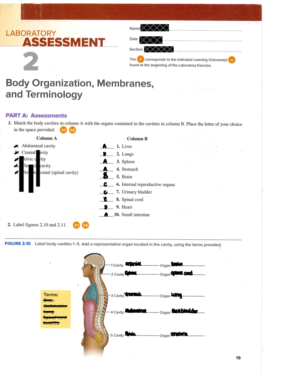 Lab Assessment 2 - A - D - I - B C C E D A cranial Brain Spinal spinal ...