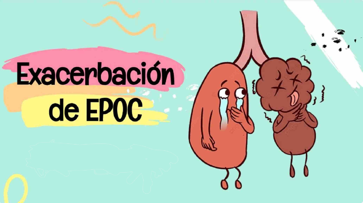 Exasperación del epoc - Tarea - Exacerbación de EPOC of Enfermedad pulmonar obstructiva crónica ...