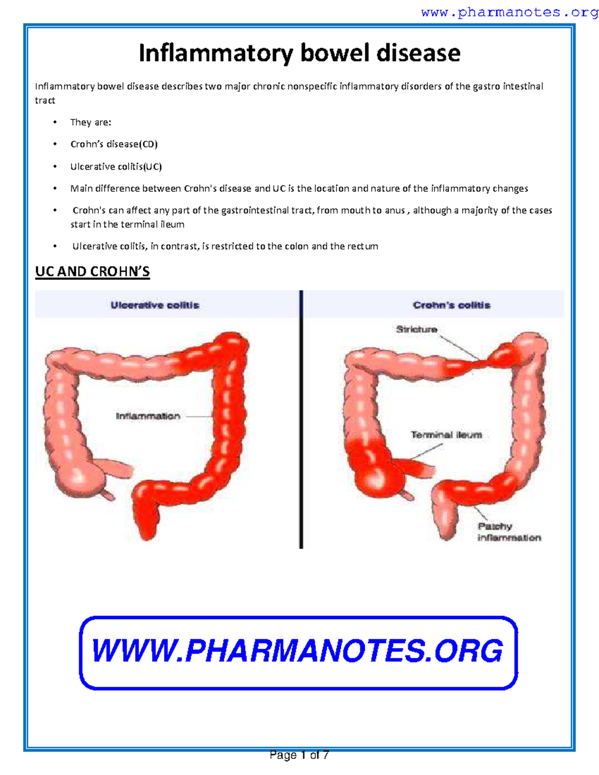 IBD - IBD - Inflammatory bowel disease Inflammatory bowel disease ...