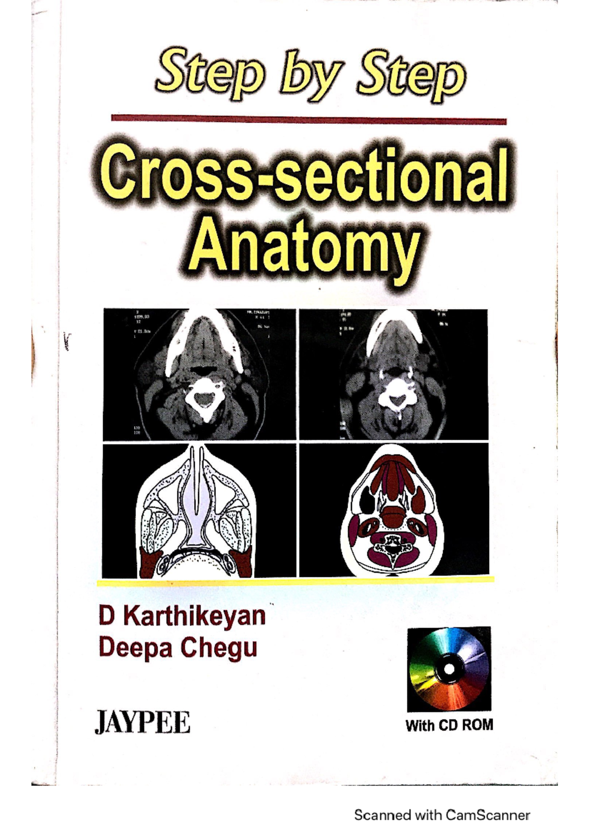 Brain CT contrast or without contrast pdf - Step Step Anatomy 21 120 ...