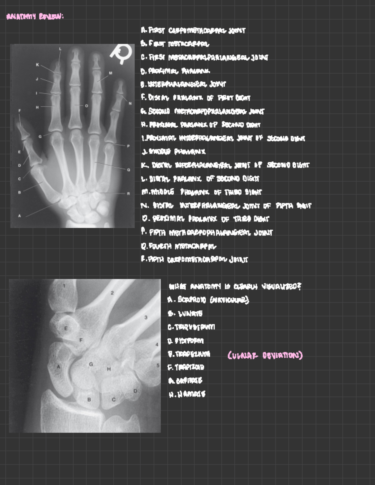 Anatomy Review Ch. 4 - Upper Extremity X-ray practice with answers ...