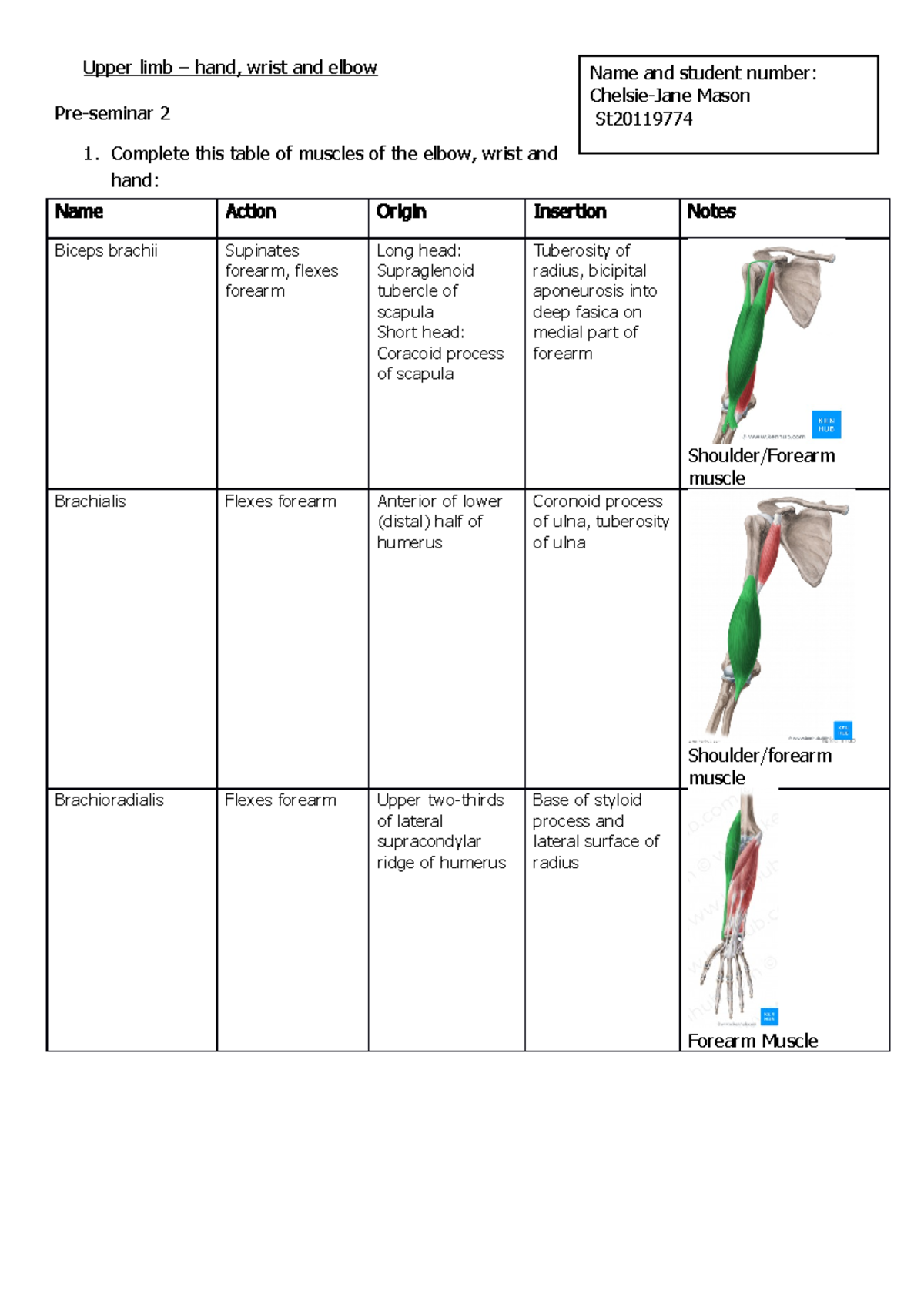Hand, Wrist, Elbow 2 - Anatomy of the spine - Upper limb – hand, wrist ...