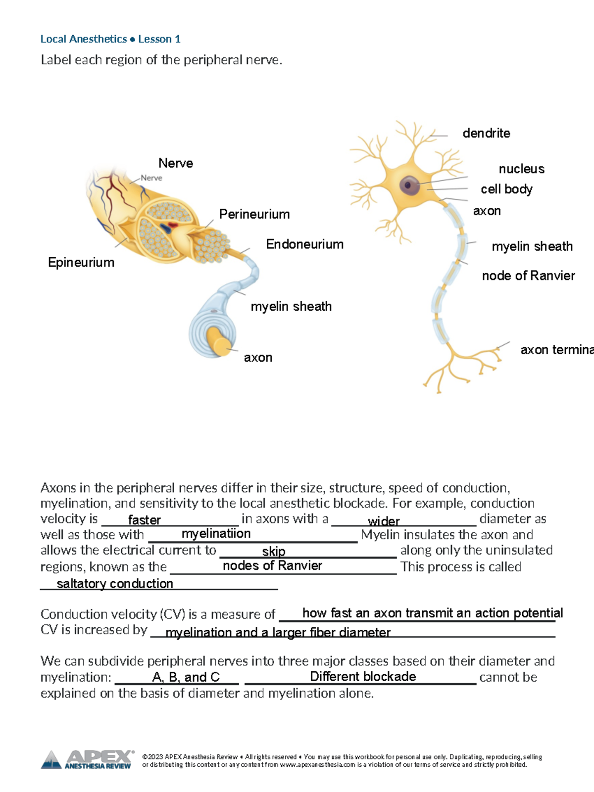 16 Local Anesthetics Workbook 2 - ©2023 APEX Anesthesia Review • All ...