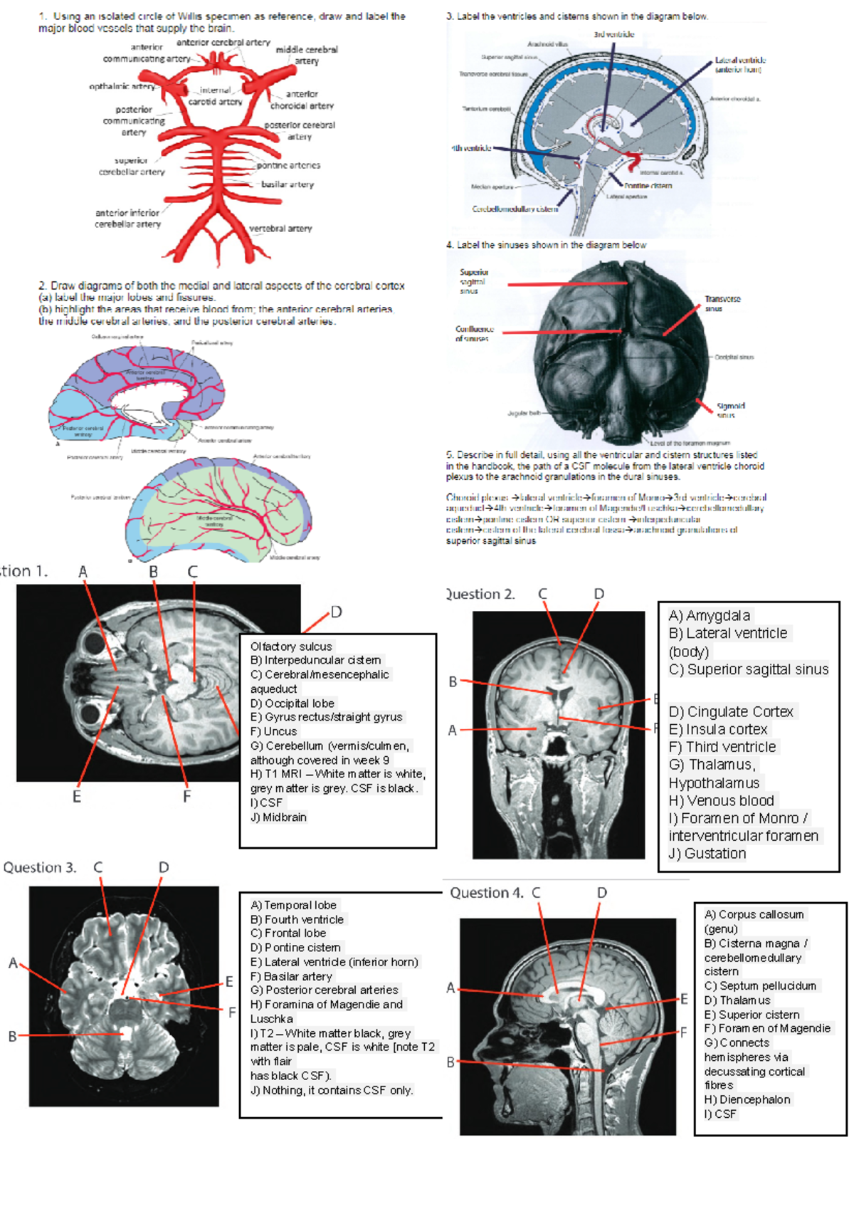NEUR3005 Notes - A) Amygdala B) Lateral ventricle (body) C) Superior ...