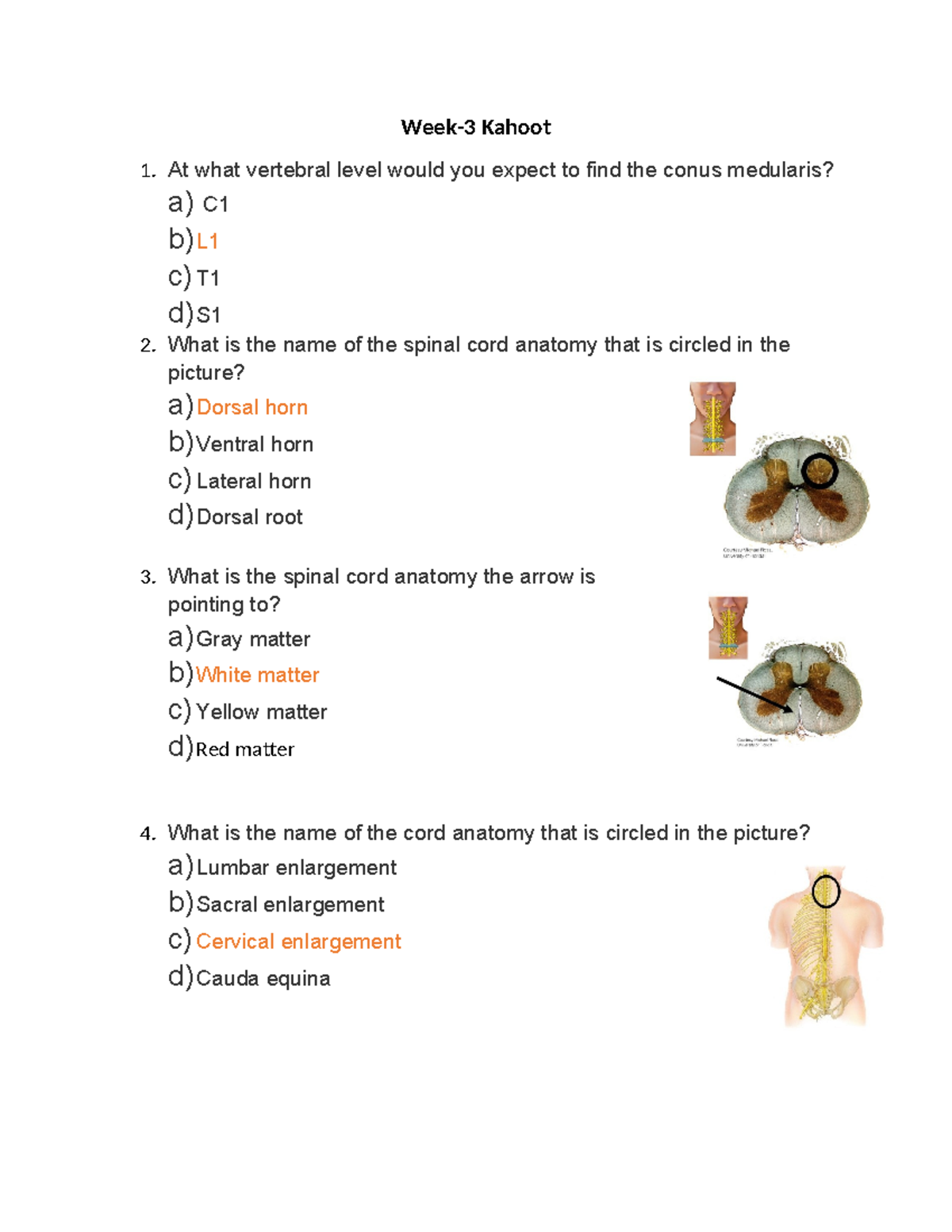 Week 3 kahoot ap2 - Week-3 Kahoot 1. At what vertebral level would you ...