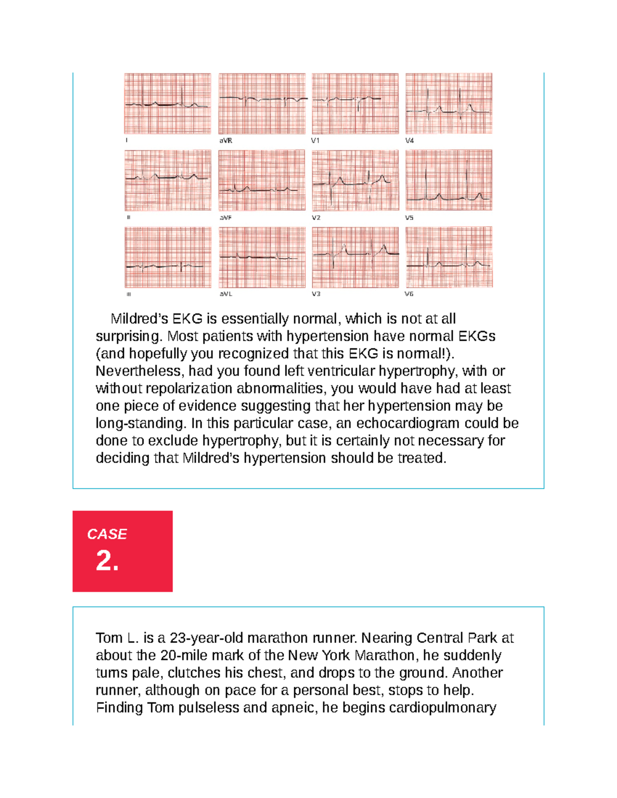 The only EKG-39 - The only EKG - Mildred’s EKG is essentially normal ...