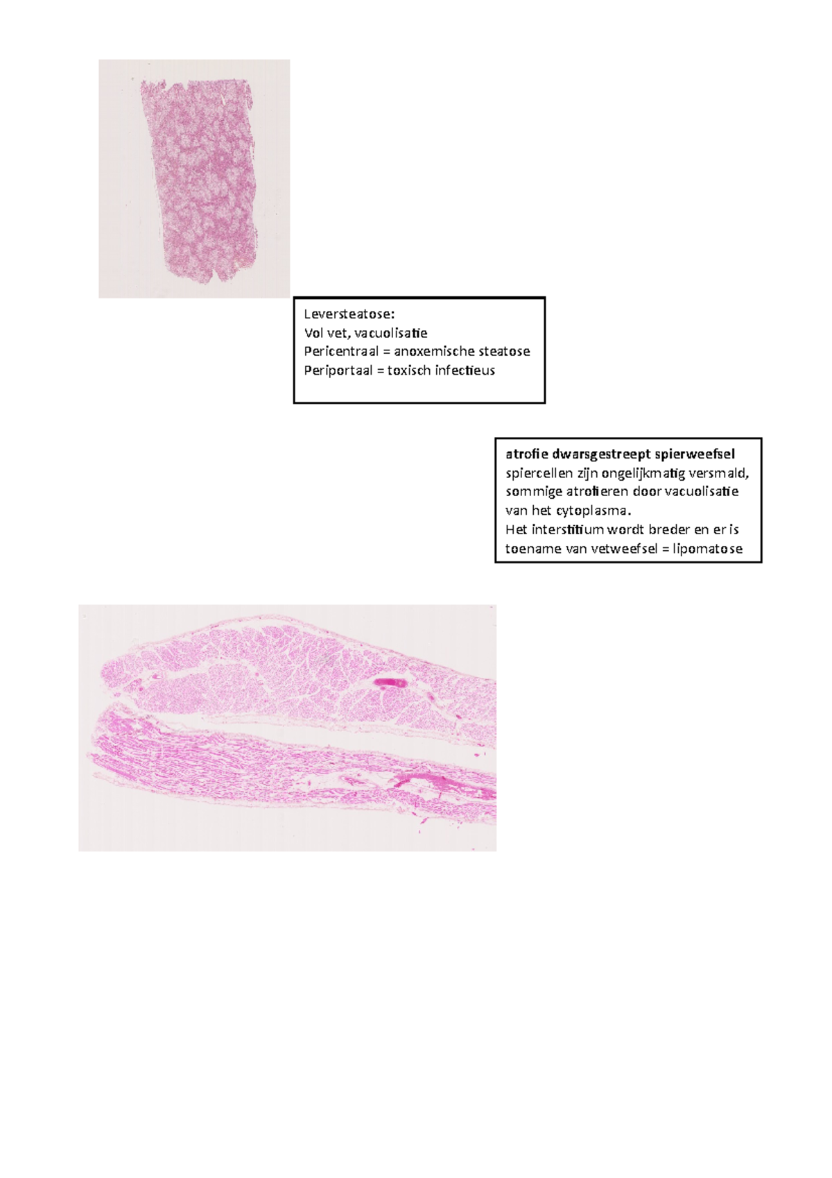 Uitleg bij de gekregen preparaten - atrofie dwarsgestreept spierweefsel ...
