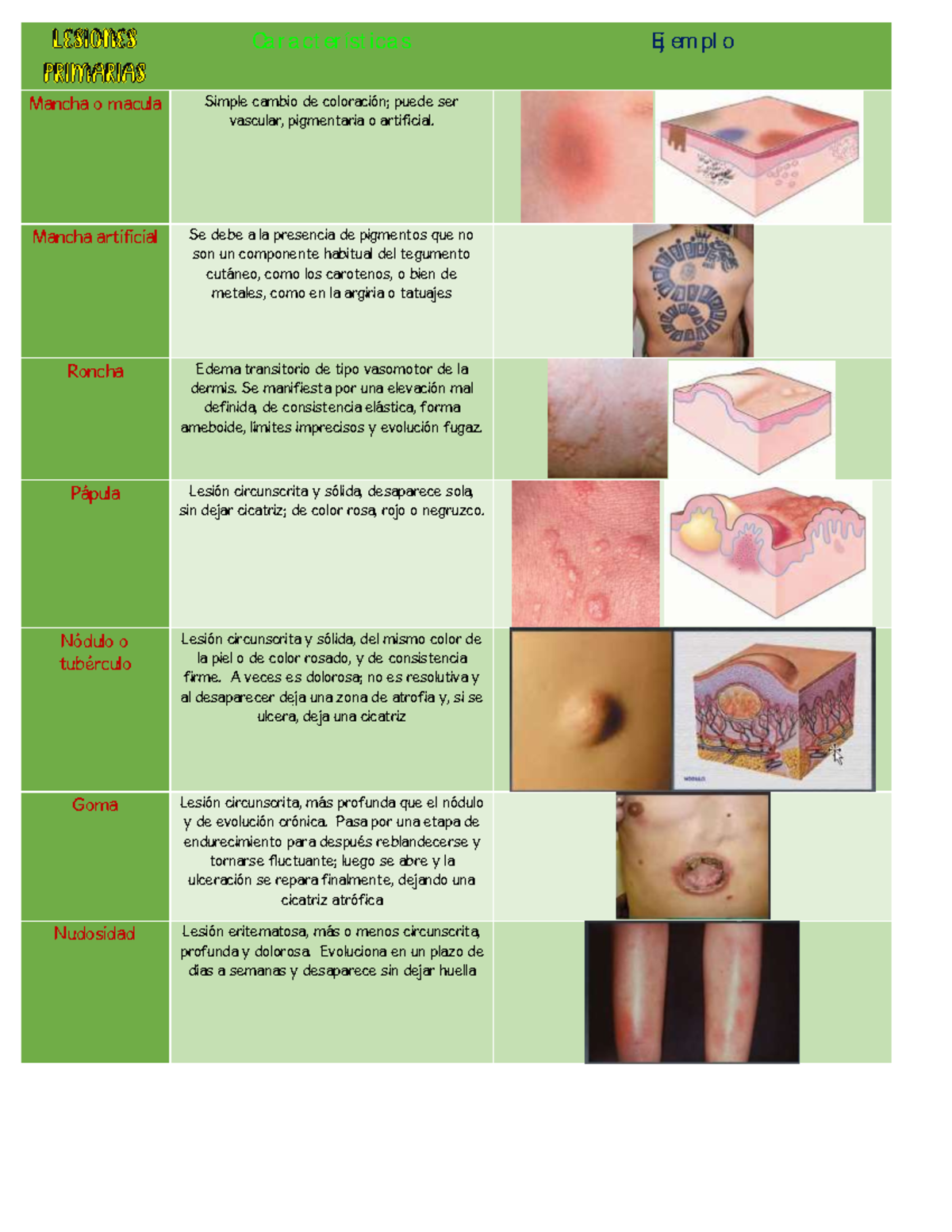 Cuadro De Lesiones Dermatológicas - Características Ejemplo Mancha o ...