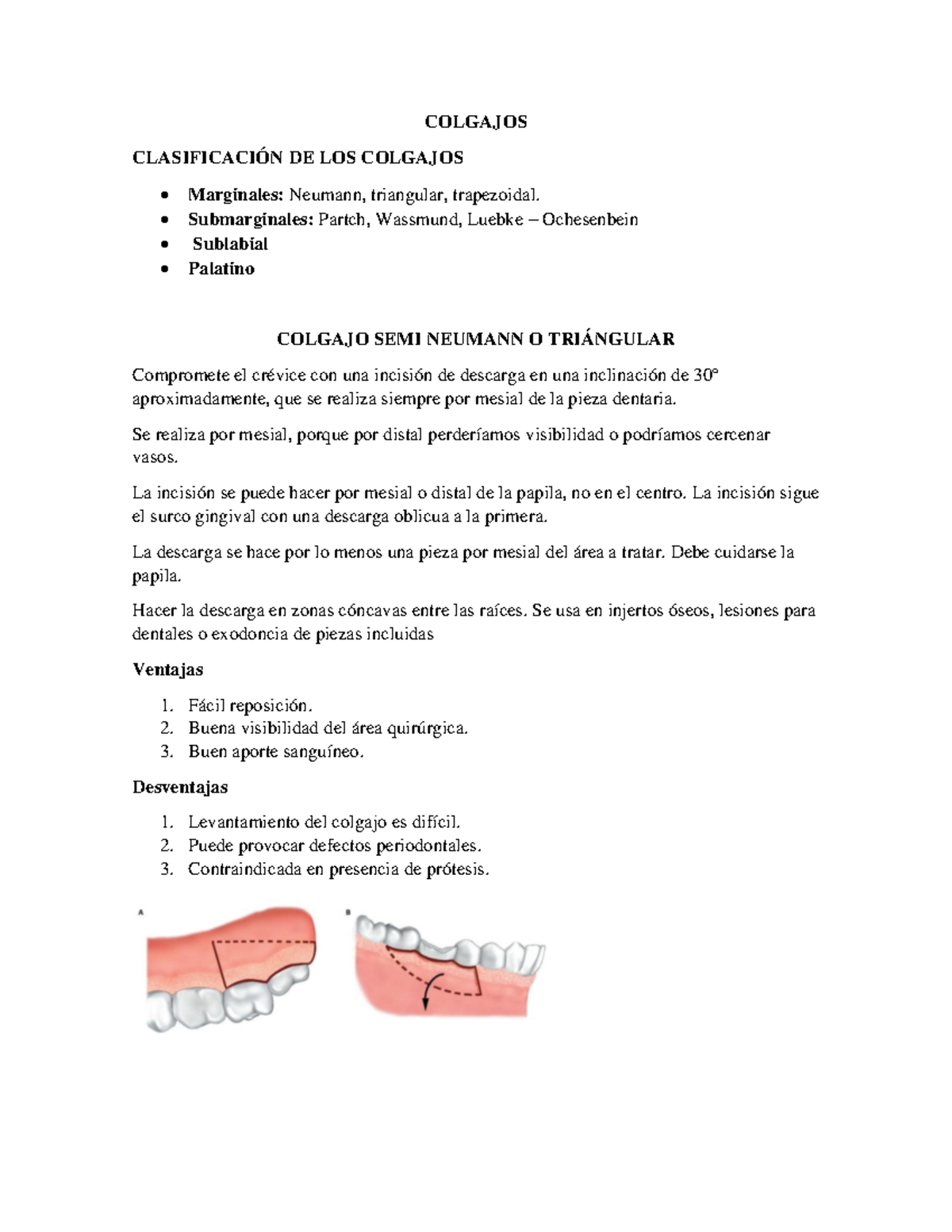 Protocolo de exodoncia - COLGAJOS CLASIFICACIÓN DE LOS COLGAJOS ...