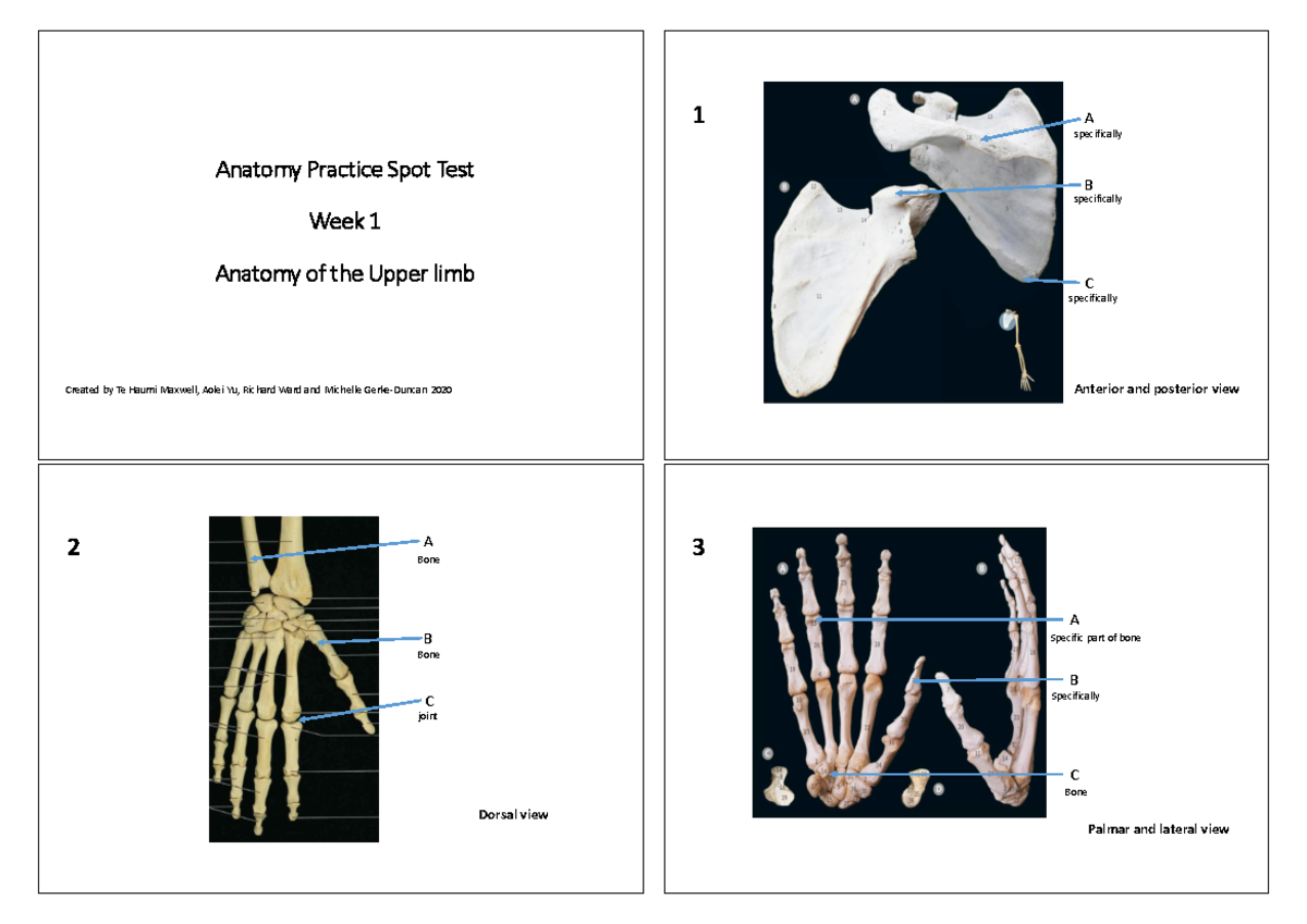 Week 1 Upper Limb Anatomy Spot Test MEDS2005 2020 - Anatomy Practice ...