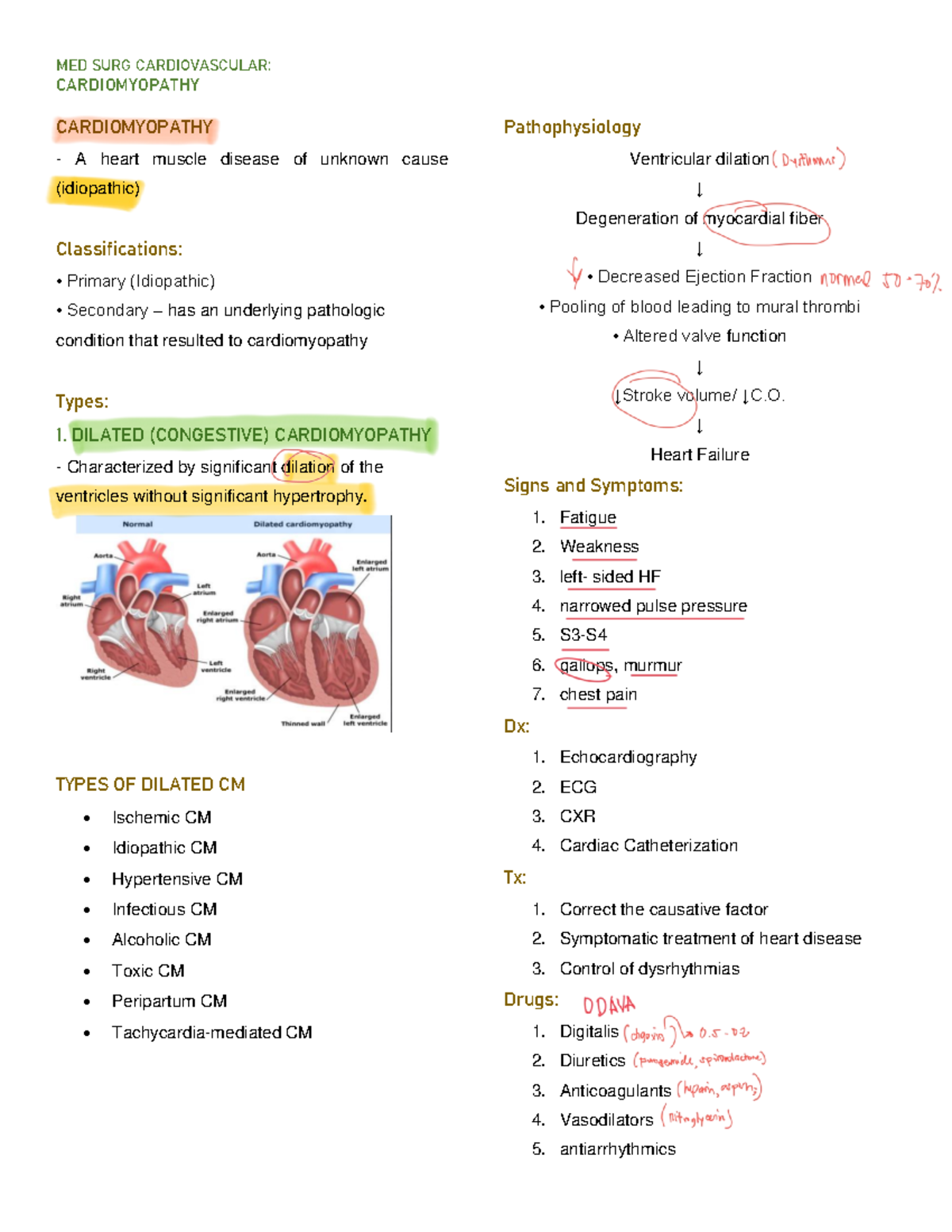 Cardiomyopathy - Nursing - CARDIOMYOPATHY CARDIOMYOPATHY - A heart ...