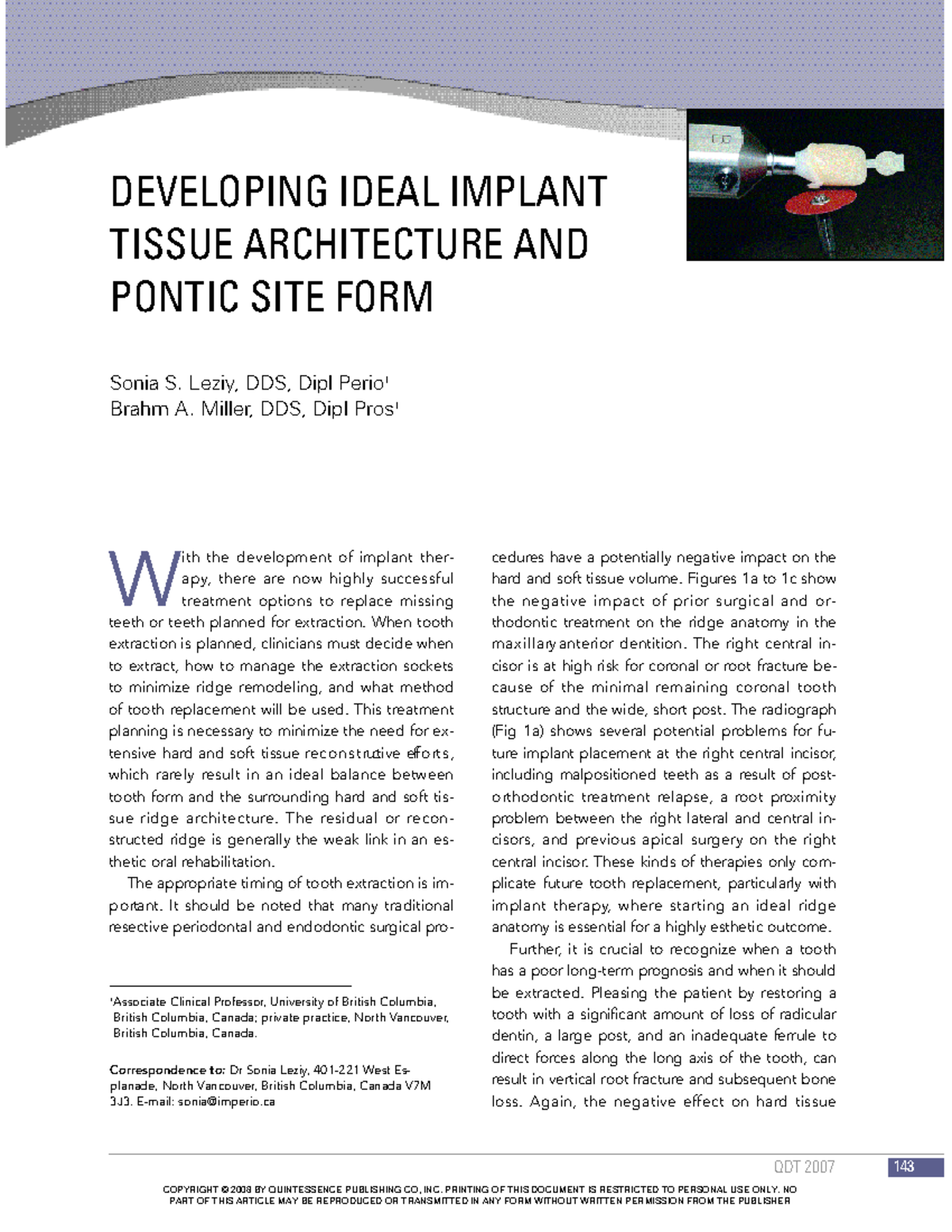 Developing Ideal Implant Tissue Architecture and Pontic Site Form - W ...