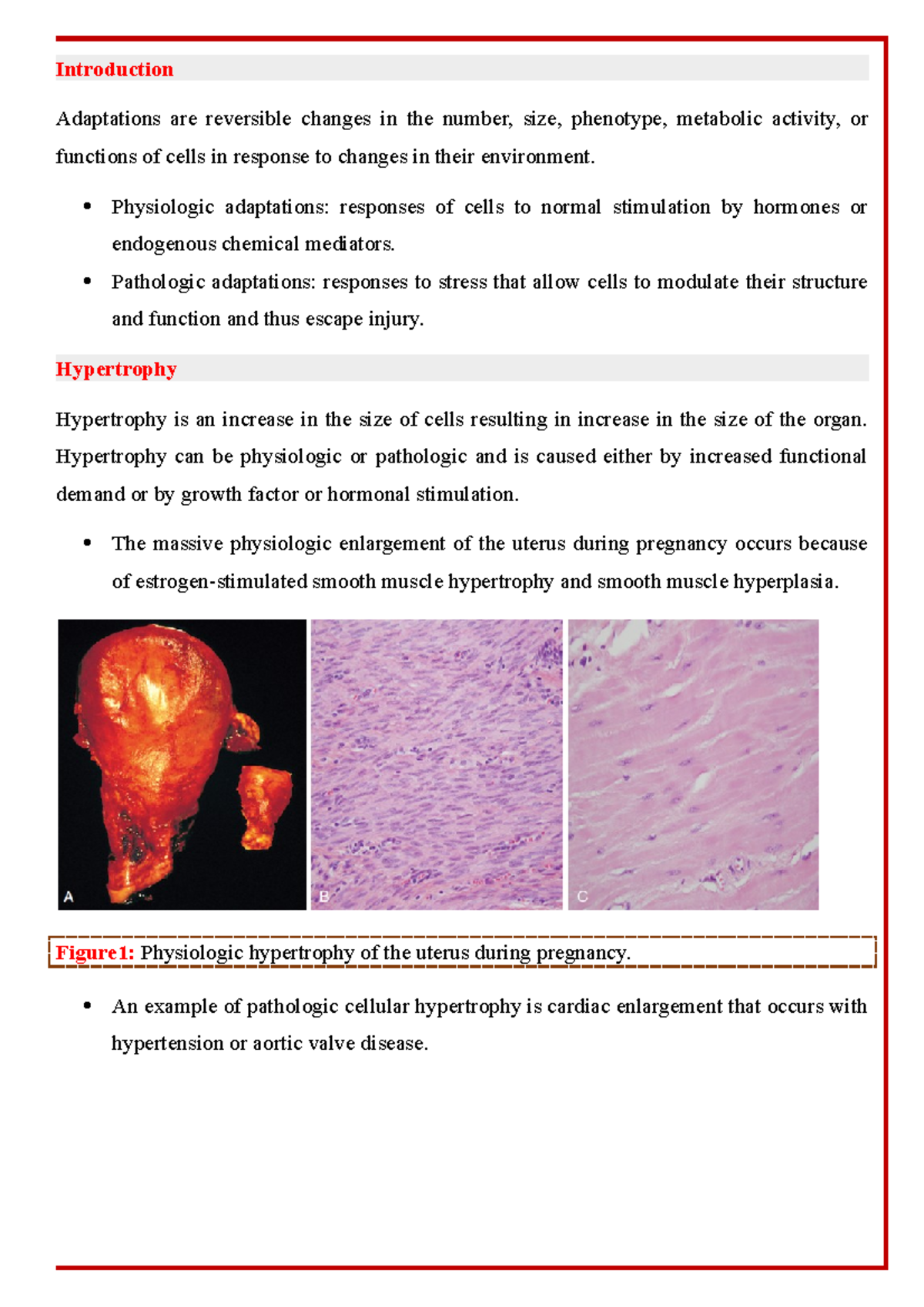 Pathology Cellular Adaptations - Introduction Adaptations are ...