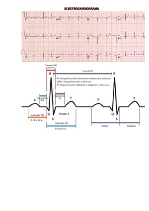supuraciones pleuropulmonares y absceso de pulmón - Buenos Aires ...