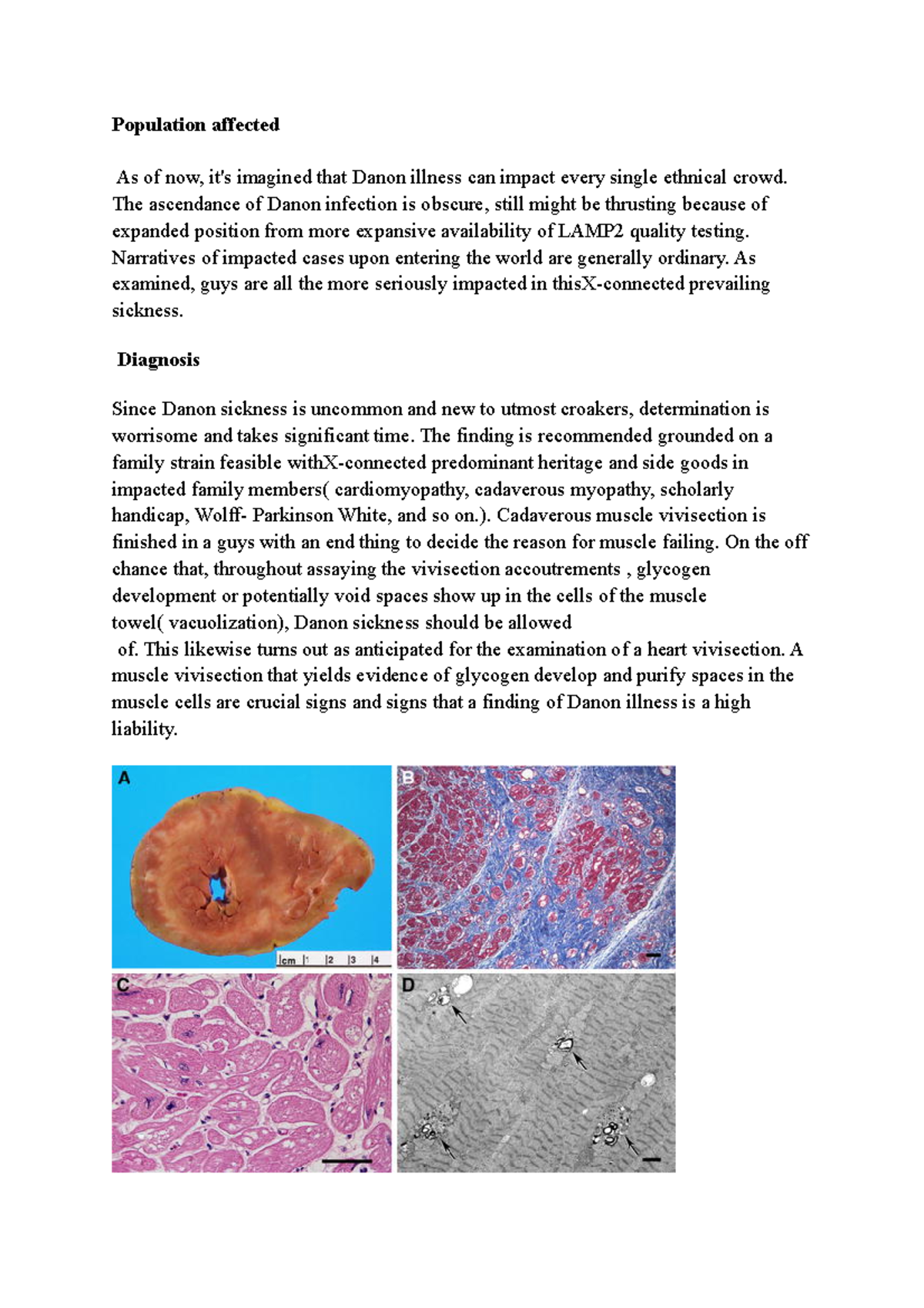 Diagnosis and treatment of Danon Disease - Population affected As of ...