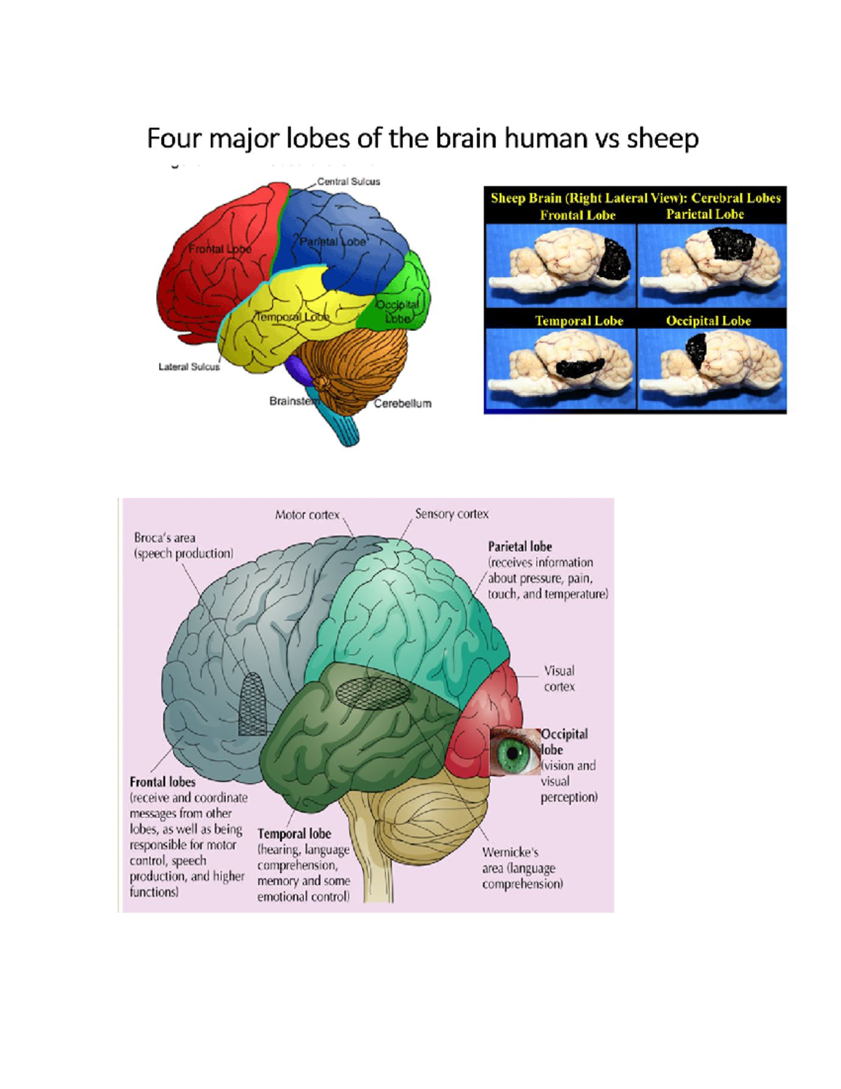 Practical - Four major lobes of the brain human vs sheep v Oenlral ...