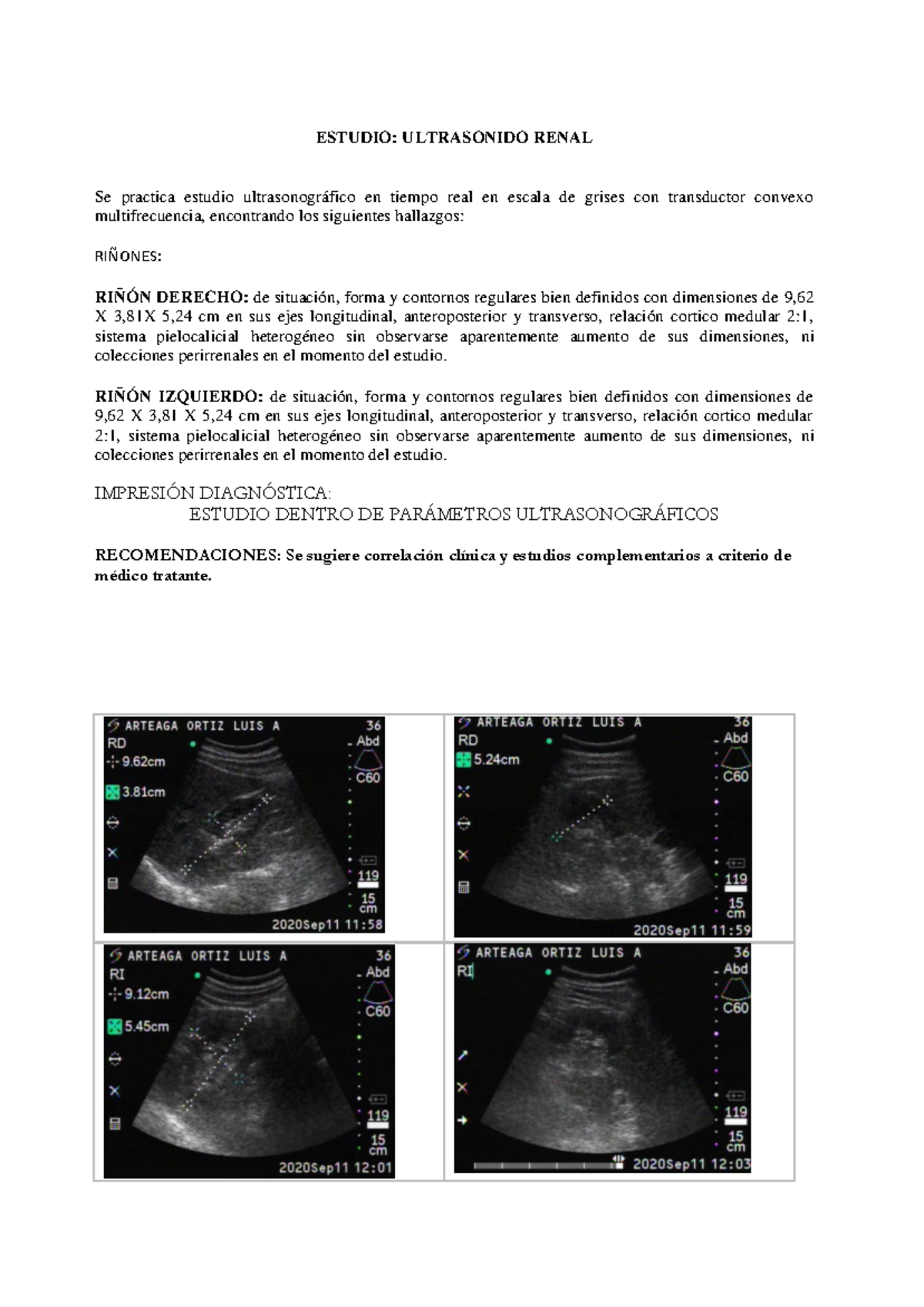 USG Renal - REPORTE ECOGRAFIA DE RIÑON - Se practica estudio ...