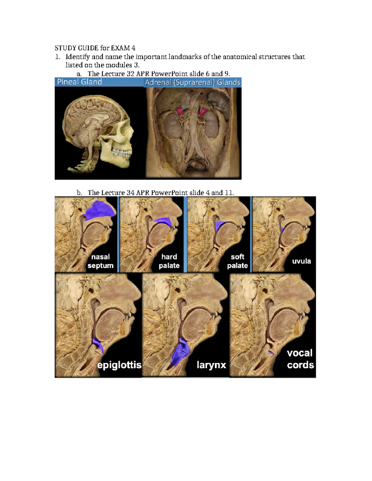 Study Guide for Exam 4 - N/A - STUDY GUIDE for EXAM 4 Identify and name ...