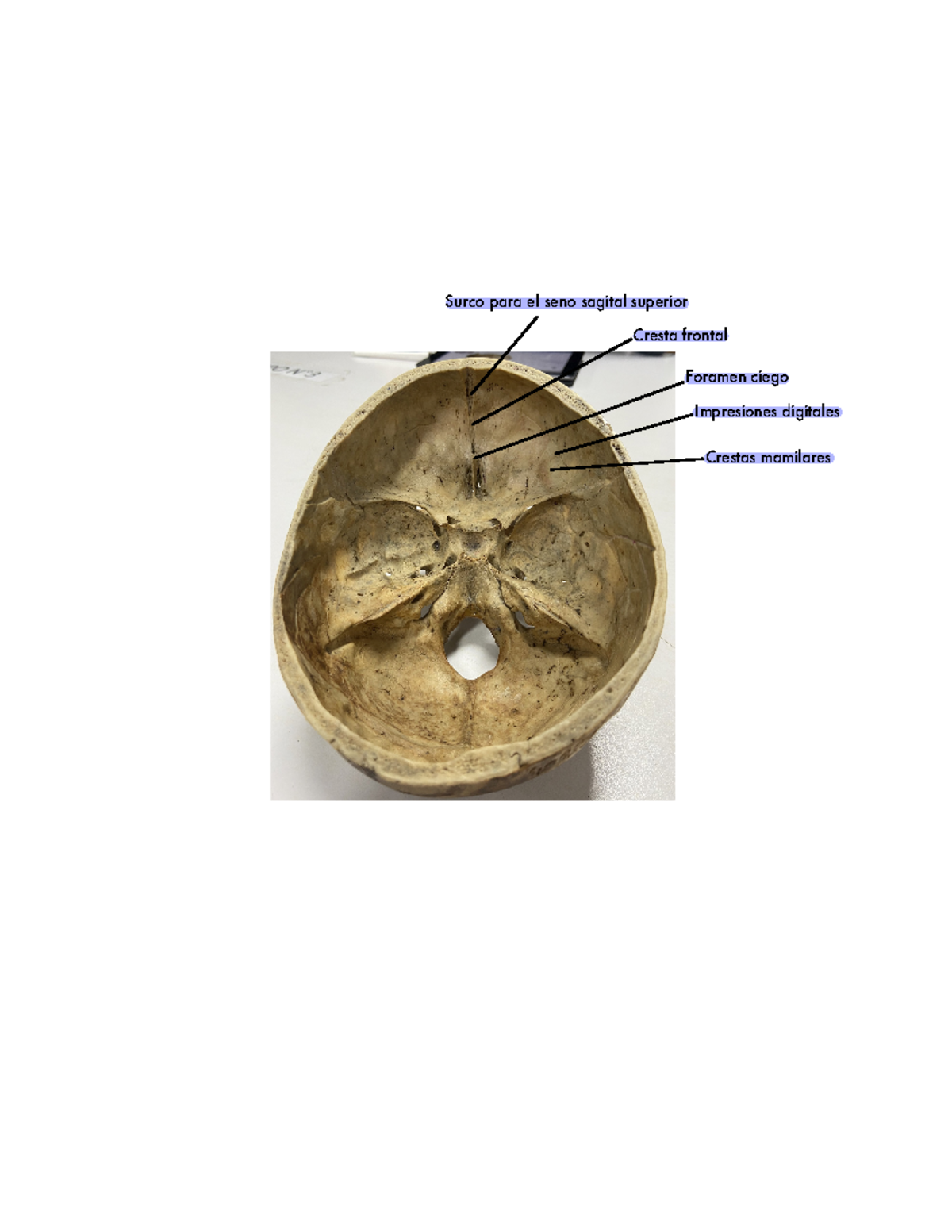Gymkana 1 - Surco para el seno sagital superior Foramen ciego Cresta ...