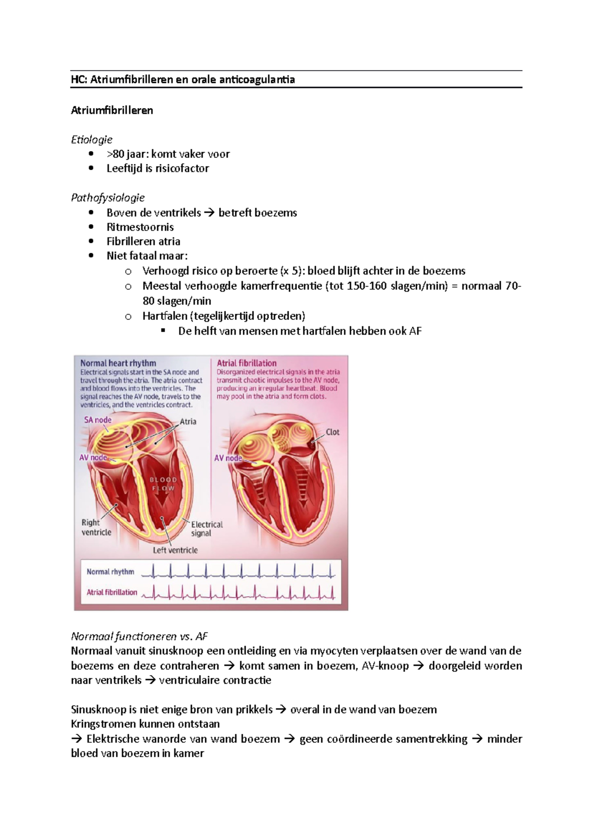 HC Atriumfibrilleren en anticoagulantia (kennisclip) - HC: Atriumfibrilleren en orale - Studeersnel