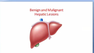 Hcc2 - Human Anatomy - Human Anatomy & Embryology - Studocu