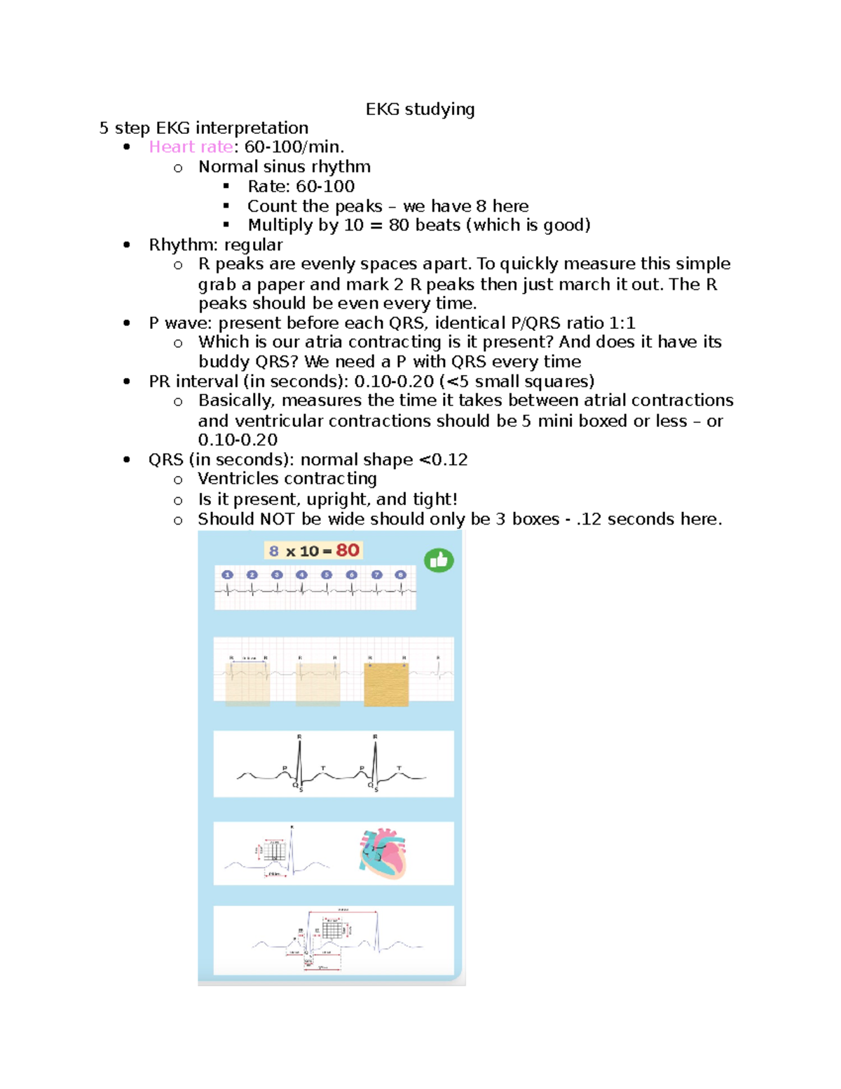 EKG studying - EKG study guide - EKG studying 5 step EKG interpretation ...