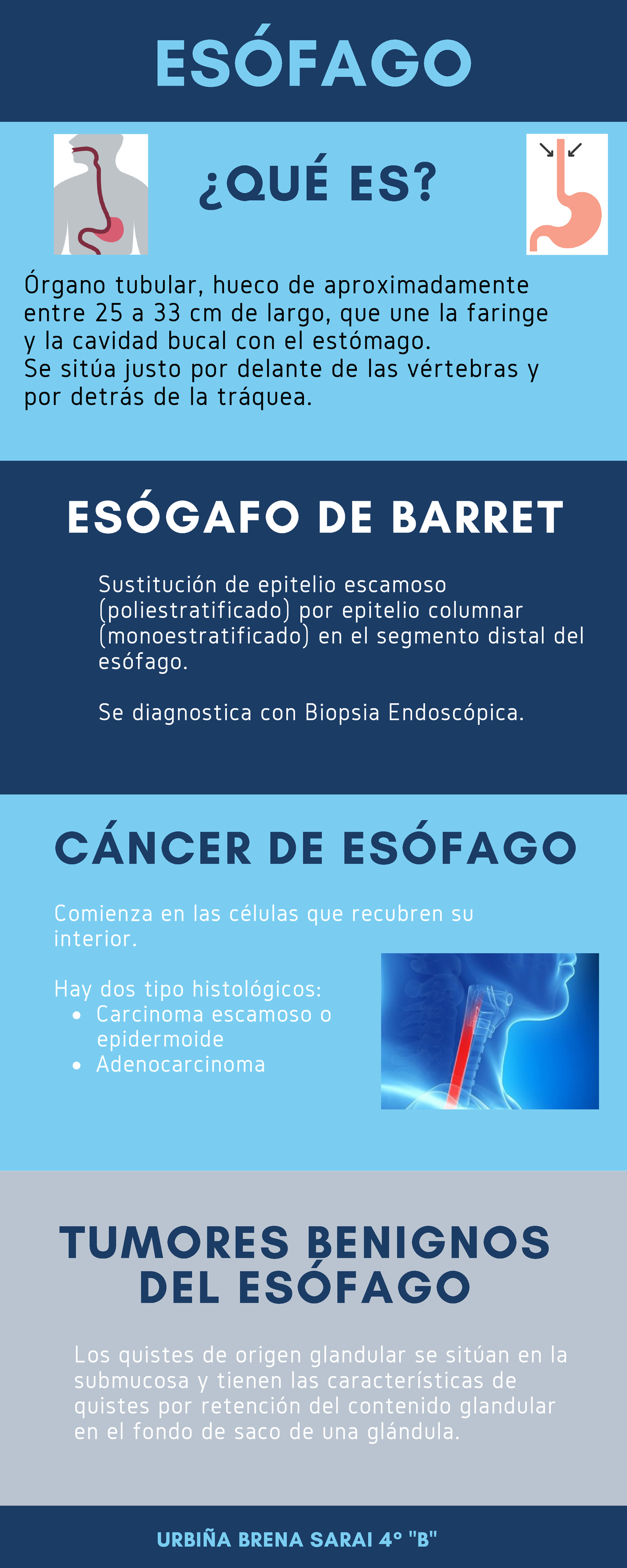 Esófago Infográfia - ñjivkgyderazds - Órgano tubular, hueco de ...