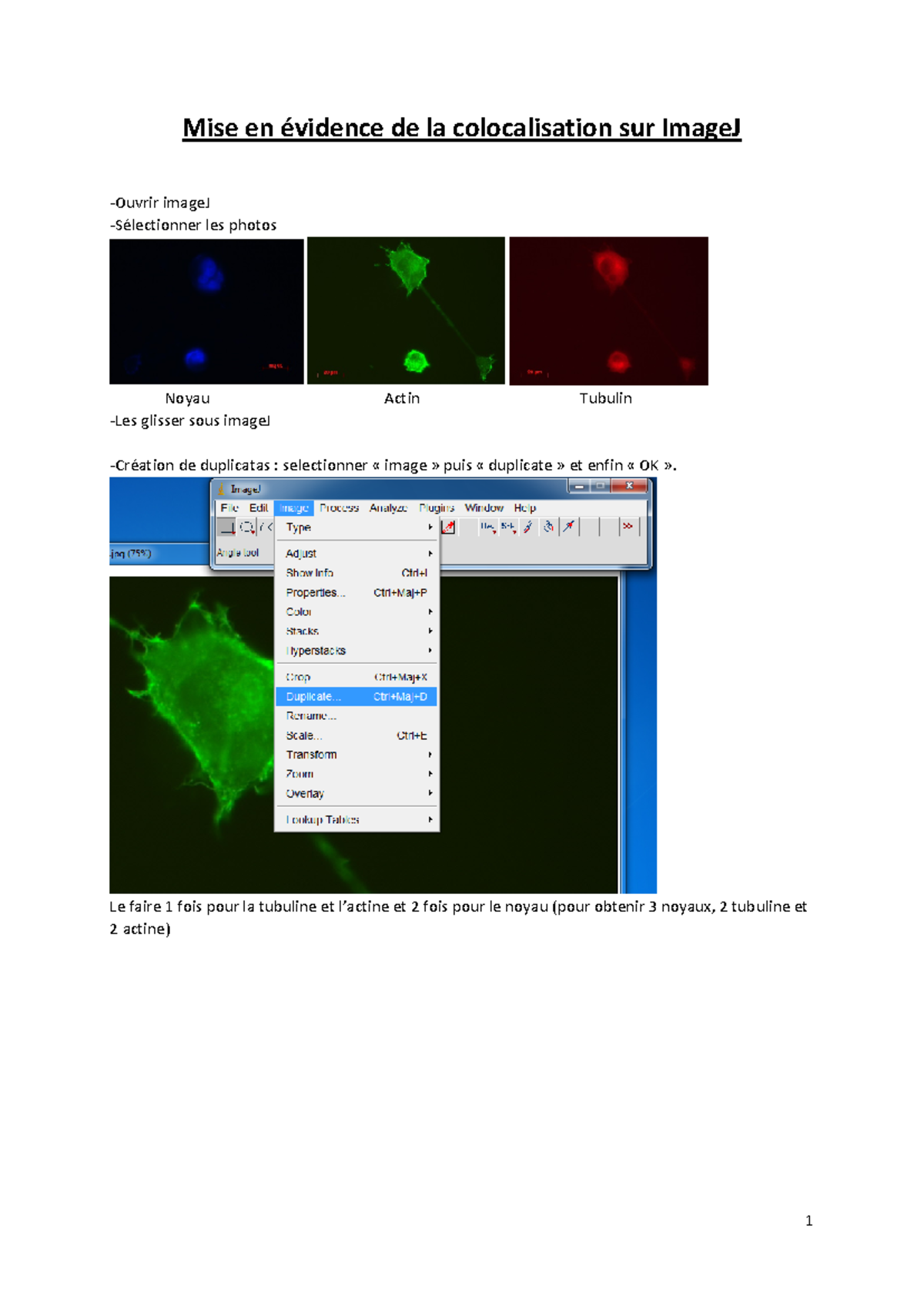 Superposition photos sur Image J - Mise en évidence de la colocalisation sur ImageJ -Ouvrir ...
