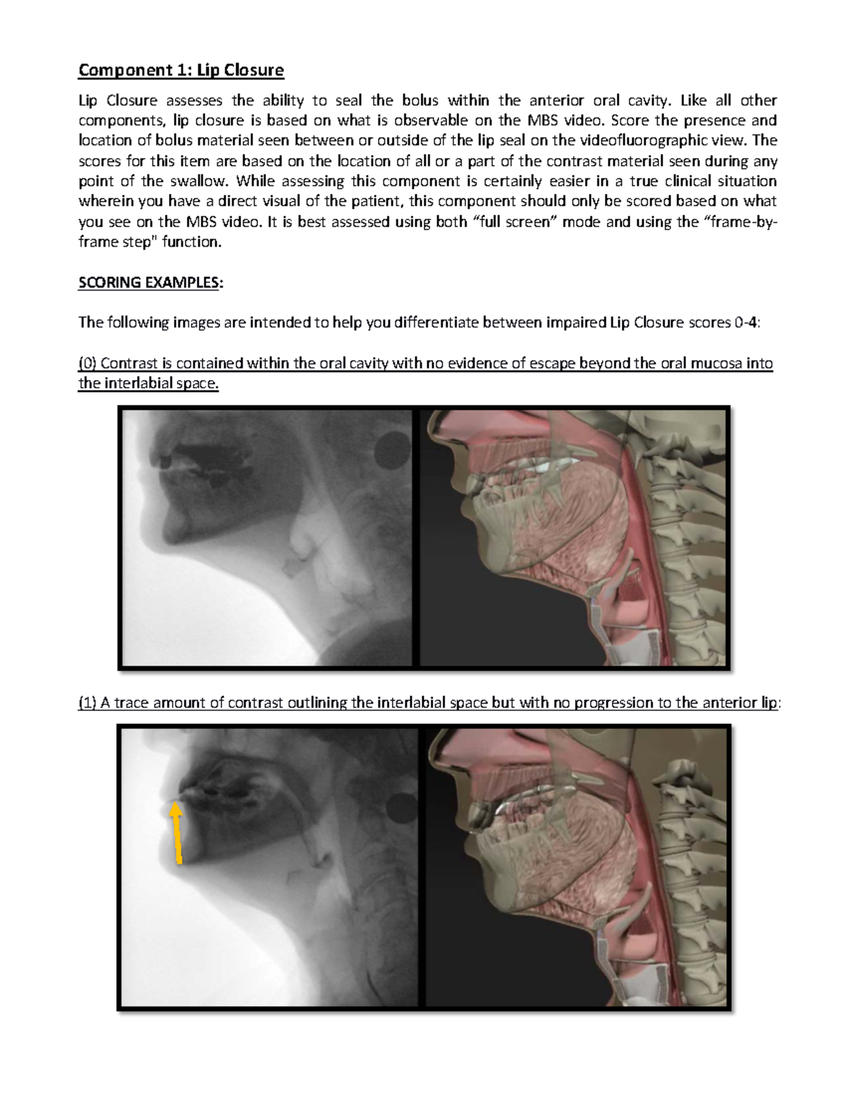 1-Lip Closure - Swallow study practice - Component 1: Lip Closure Lip ...