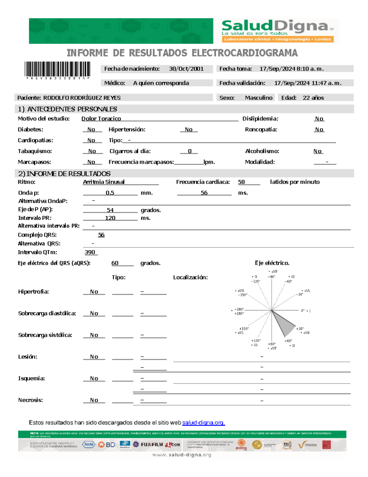 Electrocardiogramas - INFORME DE RESULTADOS ELECTROCARDIOGRAMA Fecha de ...