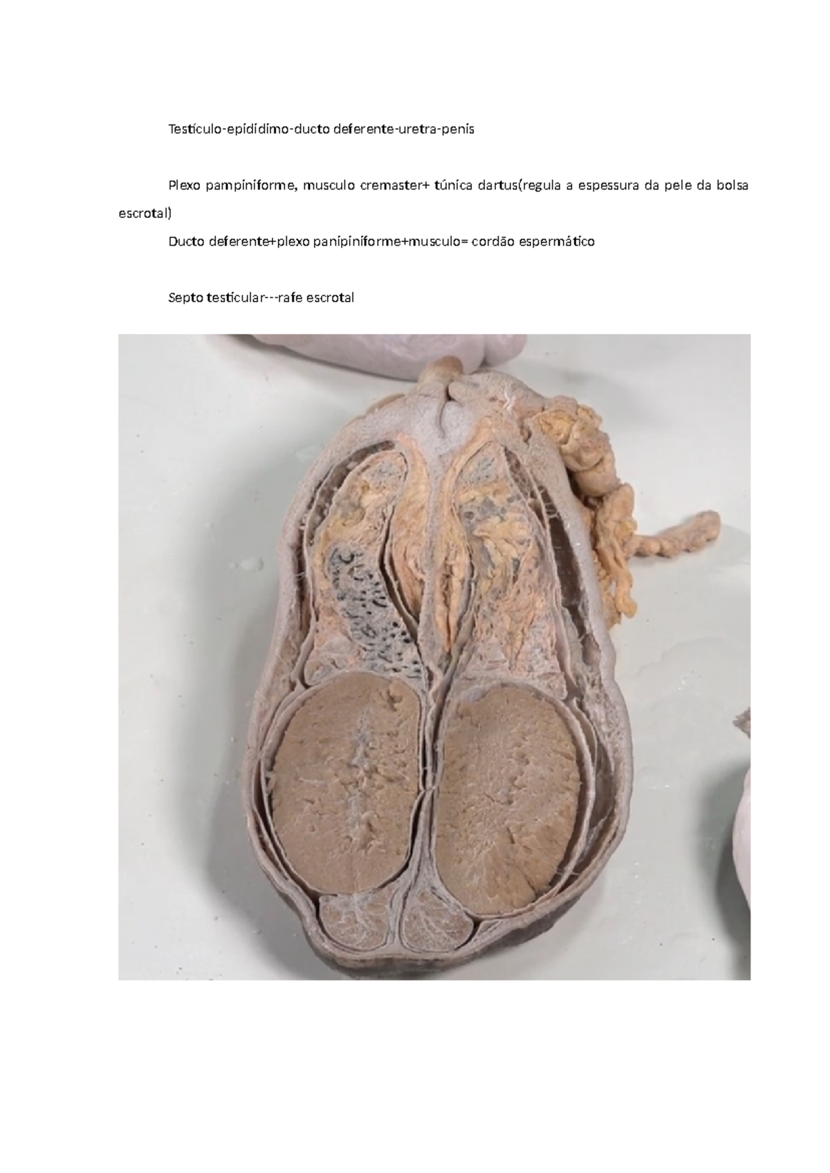 Testículo - Resumo - Andrologia Veterinária - Testículo-epididimo-ducto ...