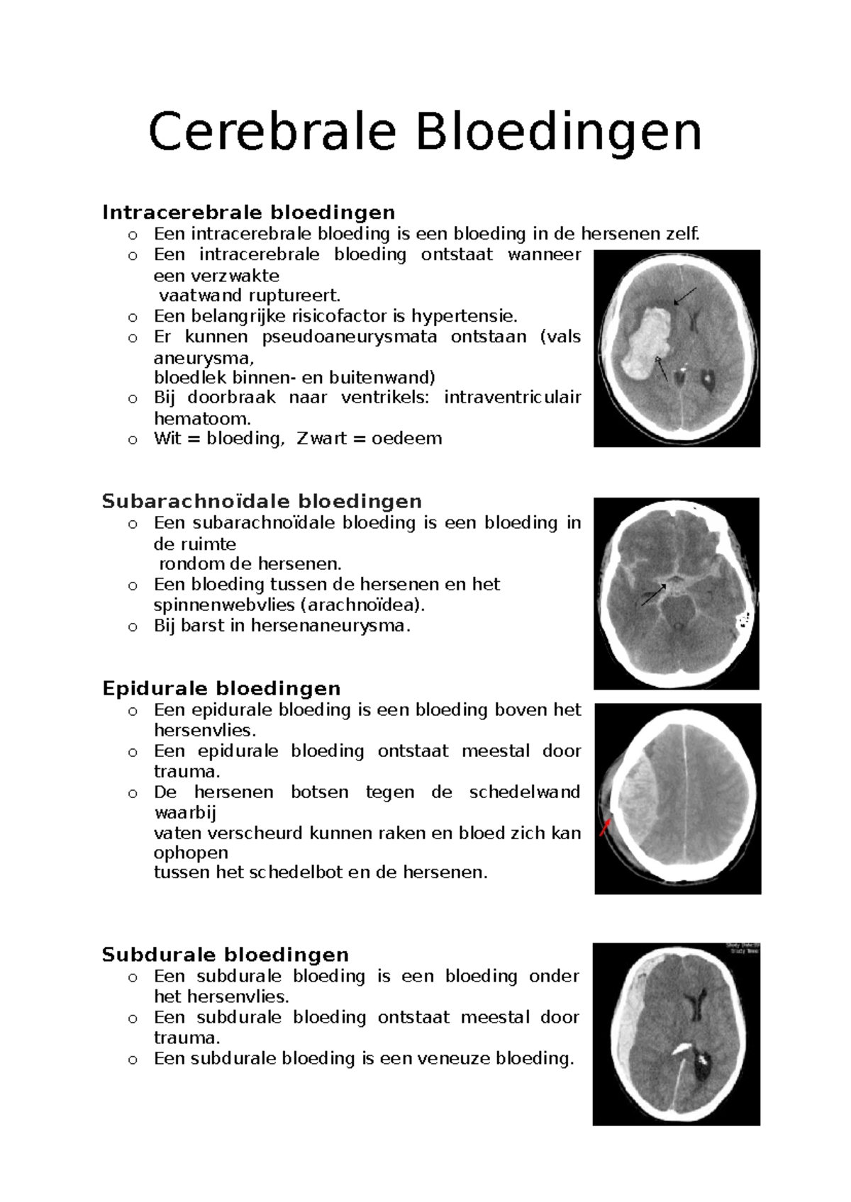 Cerebrale bloedingen & mammacarcinoom & tractus urogenitalis ...