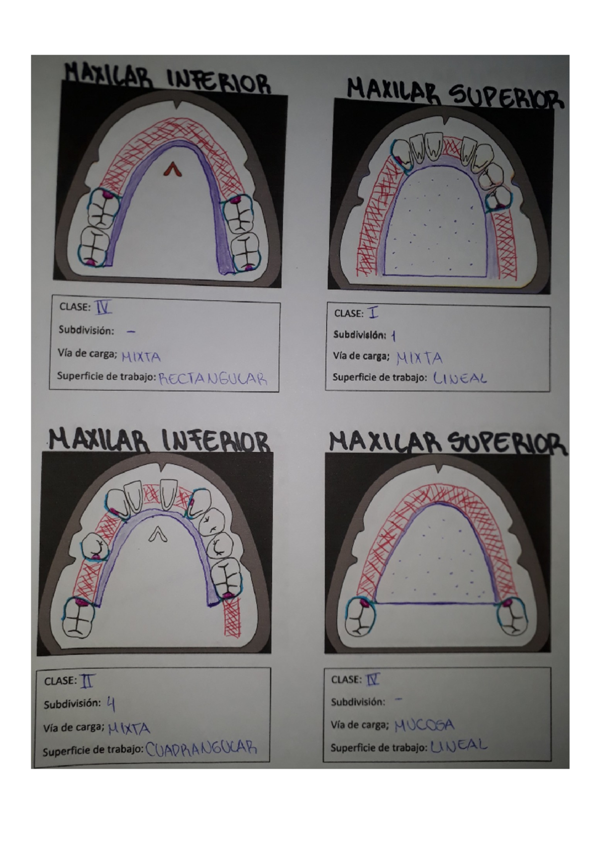 Diseño PPR - Rigonatto, Cristian Rodrigo - MAXICAR INFERIOR MAXILAR ...