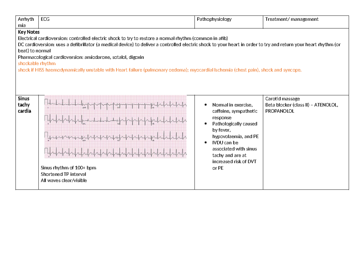Arrhythmias - with edits - Arrhyth mia ECG Pathophysiology Treatment ...