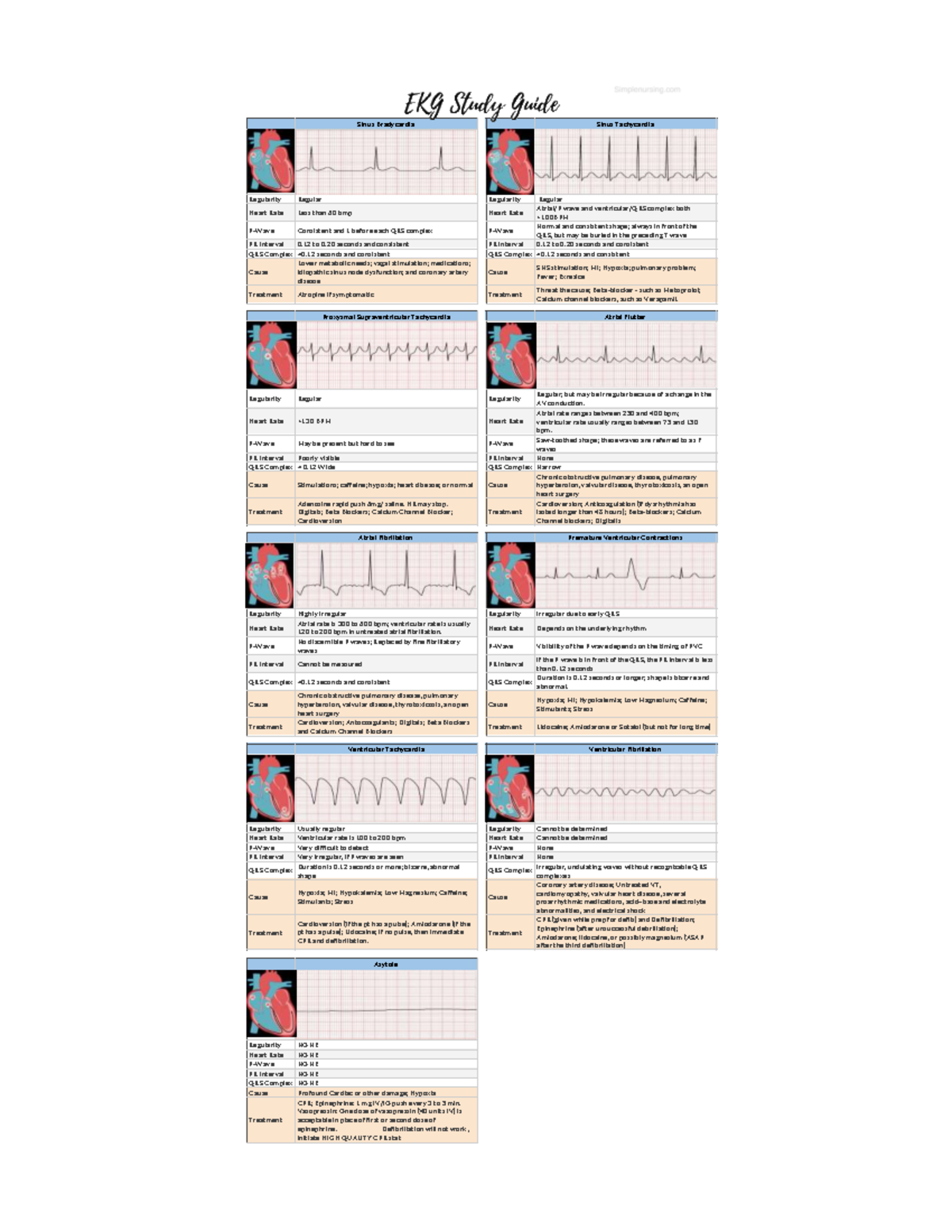 EKG Dysrhythmias - Simple nursing doc - Sinus Bradycardia Sinus ...