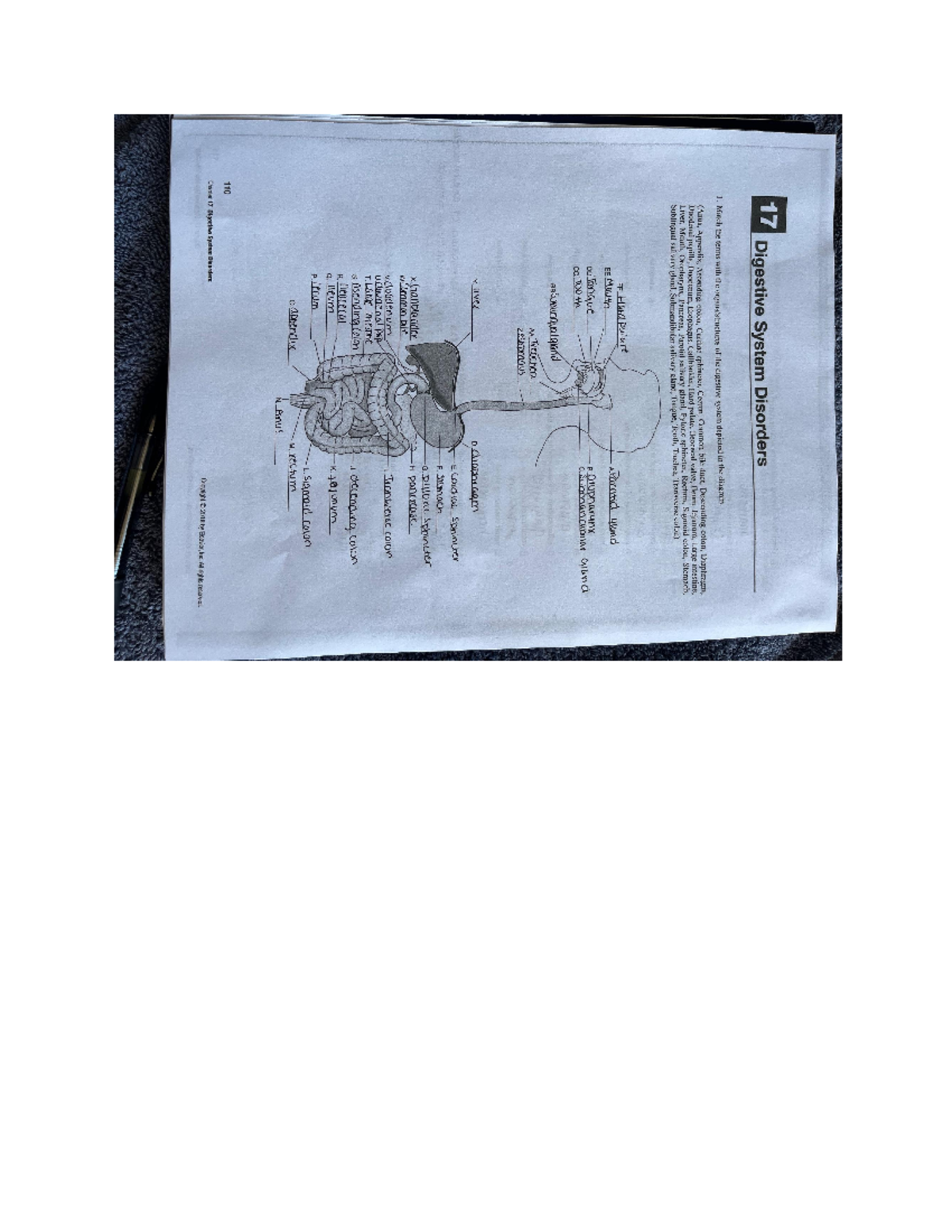 Study guide 17 - 17 Digestive System Disorders 1. Match the terms with ...