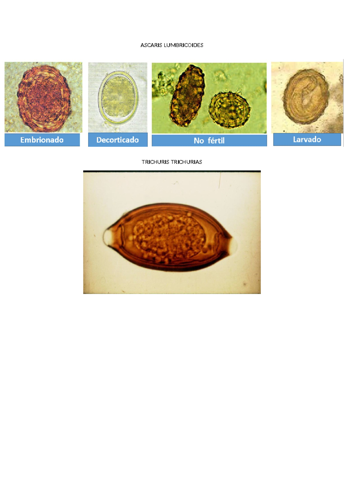 Parasito pc2 - PARASITOLOGIA - ASCARIS LUMBRICOIDES Embrionado ...