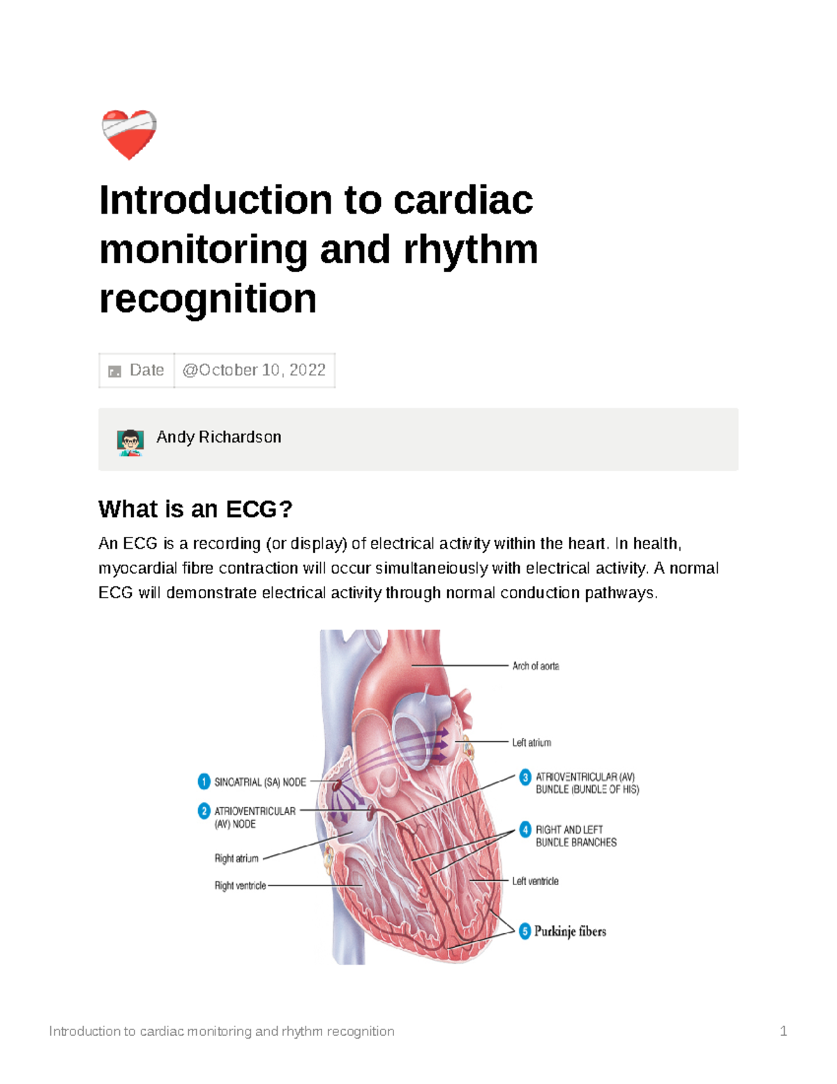 Introduction to cardiac monitoring and rhythm recognition ...
