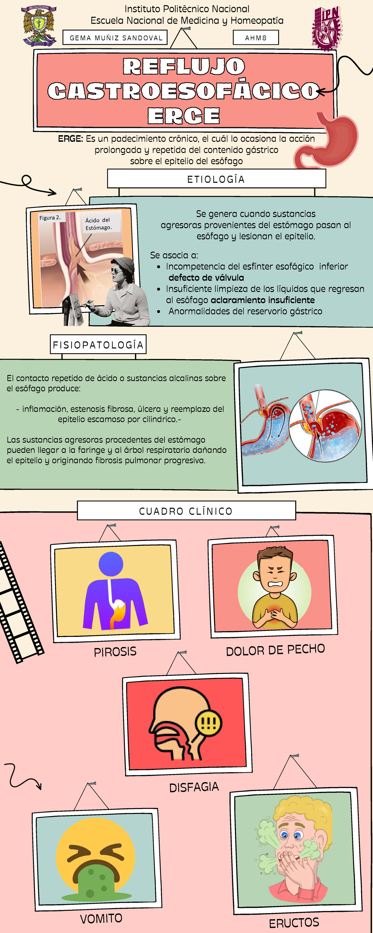 Gema Muñiz Sandoval Infografía-Reflujo Gastroesofágico ERGE - F I S I O ...