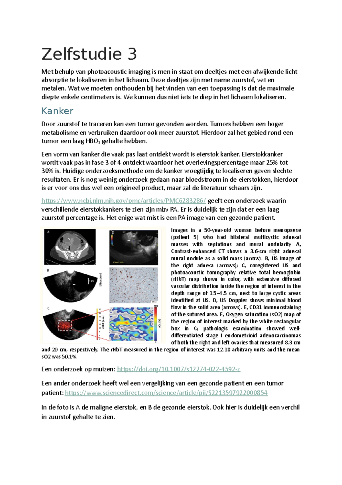 Zelfstudie 3 ogo oxy - Zelfstudie 3 Met behulp van photoacoustic ...