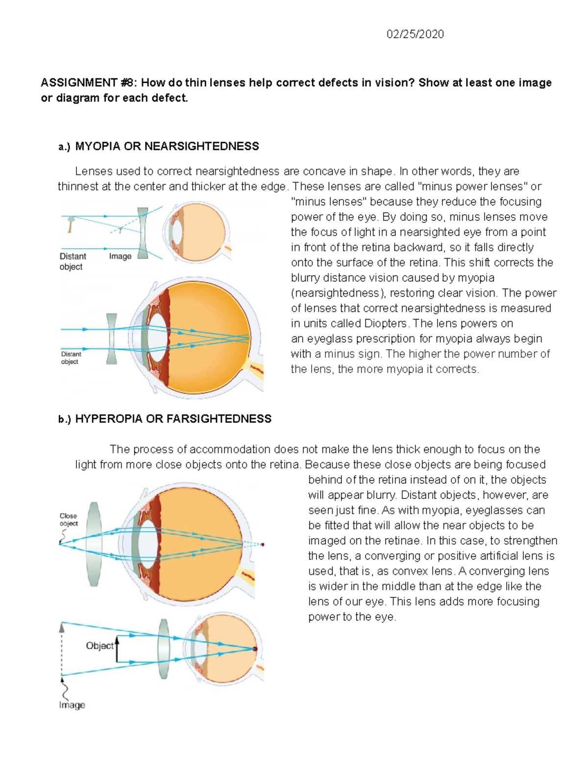 HW #8 - How do thin lenses help correct defects in vision? Show at ...