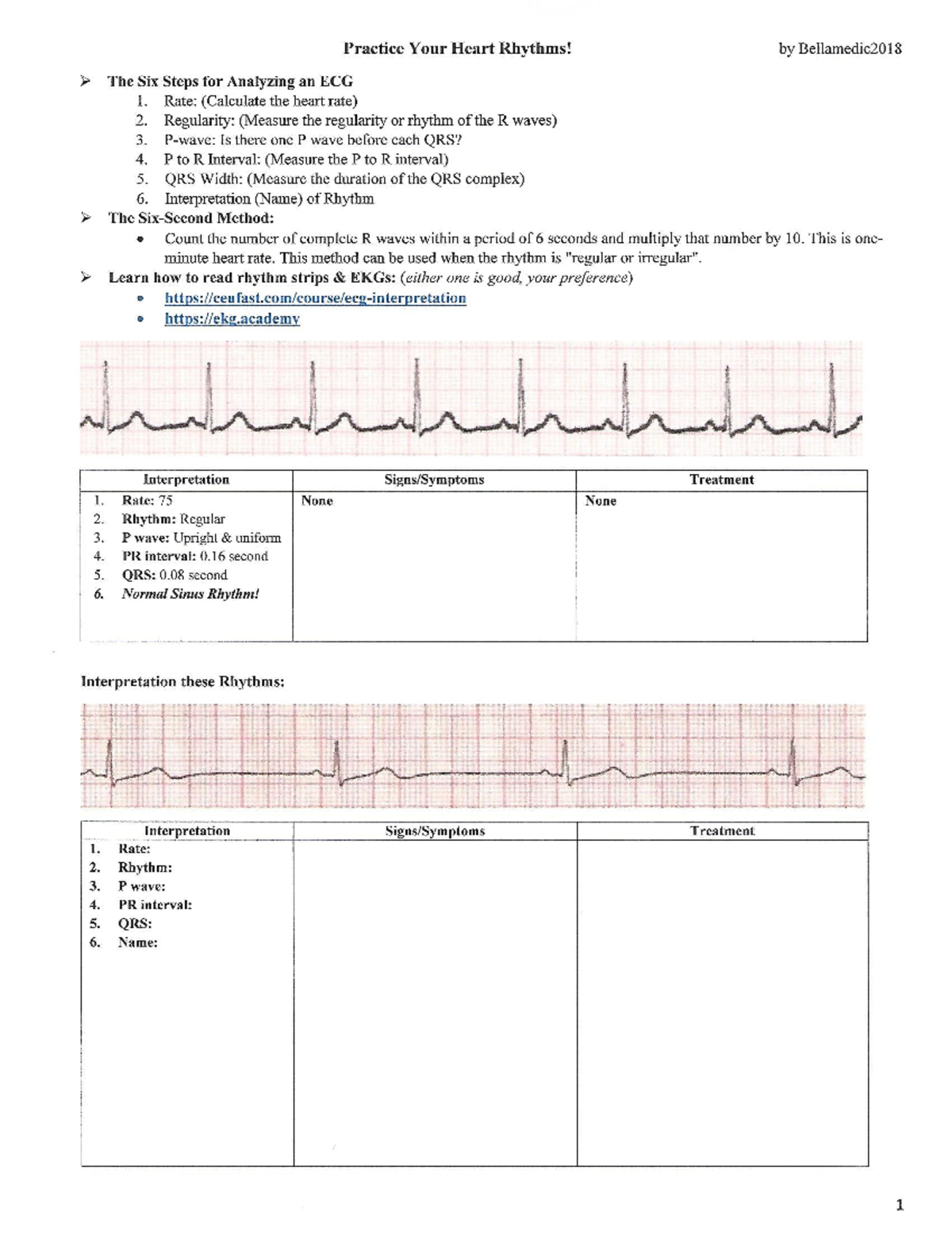 Practice Cardiac Rhythms Nursing Practice - Practice Your Heart Rhythms ...