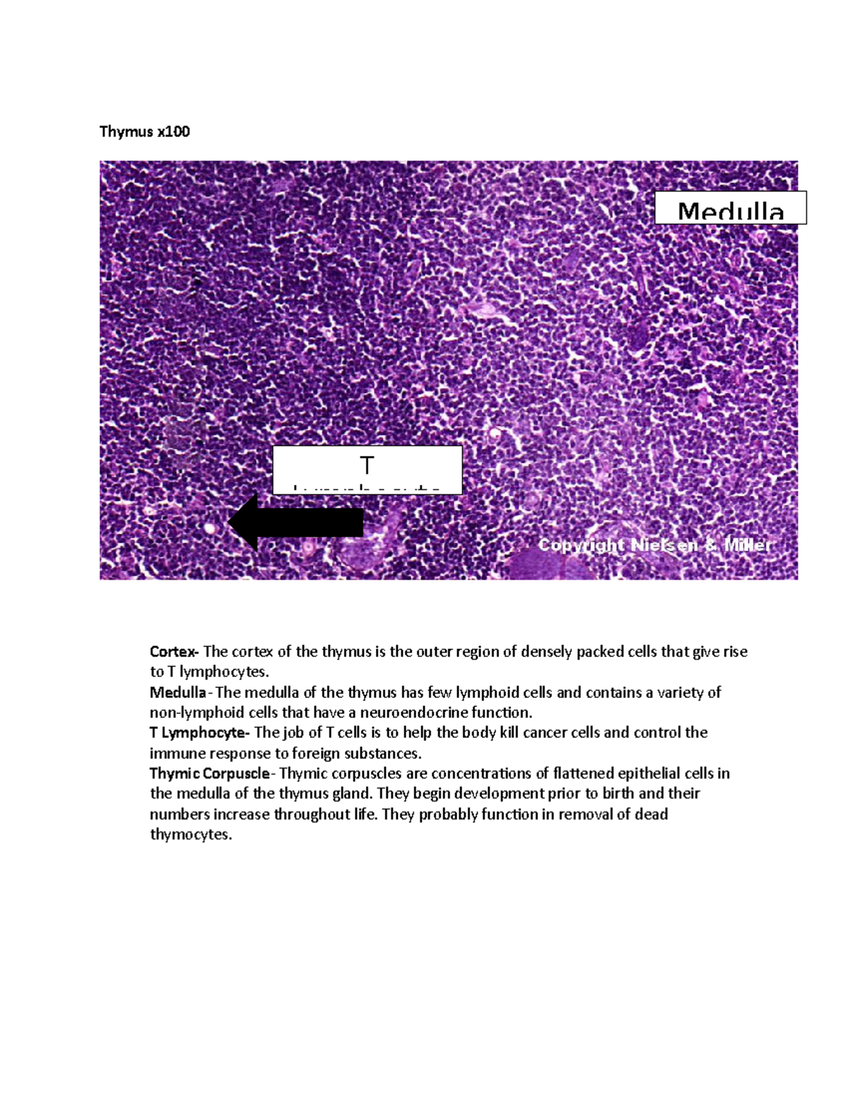 Lab 4 - lab - Thymus x Cortex- The cortex of the thymus is the outer ...