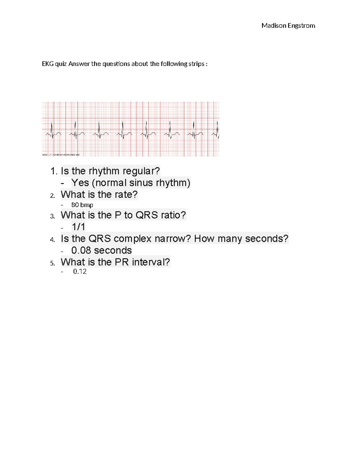 EKG Interpretation - notes - Madison Engstrom EKG quiz Answer the ...