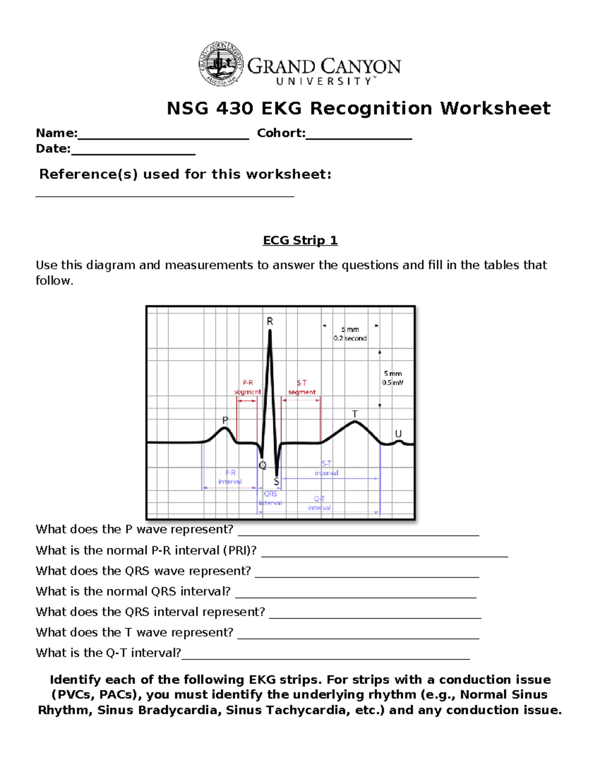 NSG-430-RS-ECG Worksheet - NSG 430 EKG Recognition Worksheet Name NSG-430-RS-ECG Worksheet - NSG 430 EKG Recognition Worksheet Name