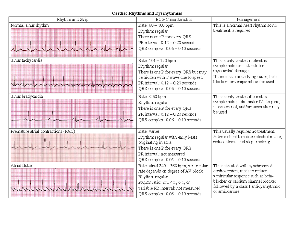 Cardiac-Dysrhythmias - Cardiac Rhythms and Dysrhythmias Rhythm and ...