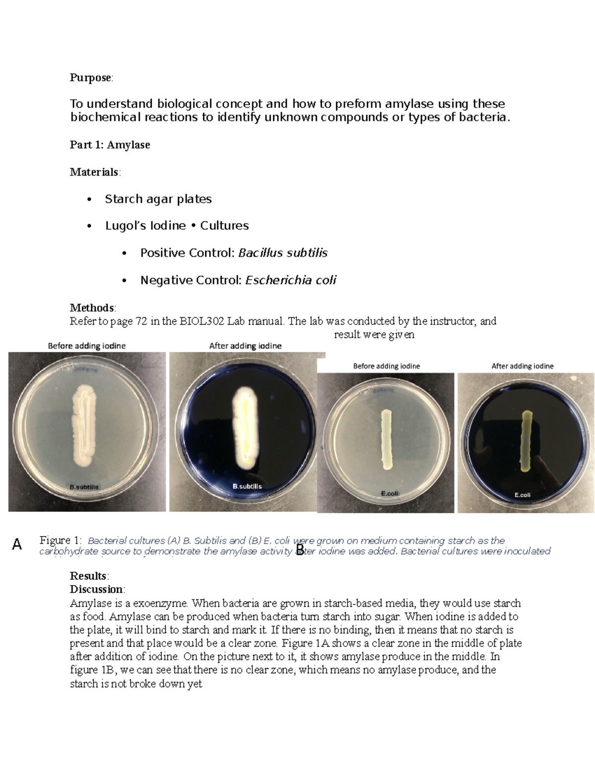Amylase - Purpose : To understand biological concept and how to preform ...