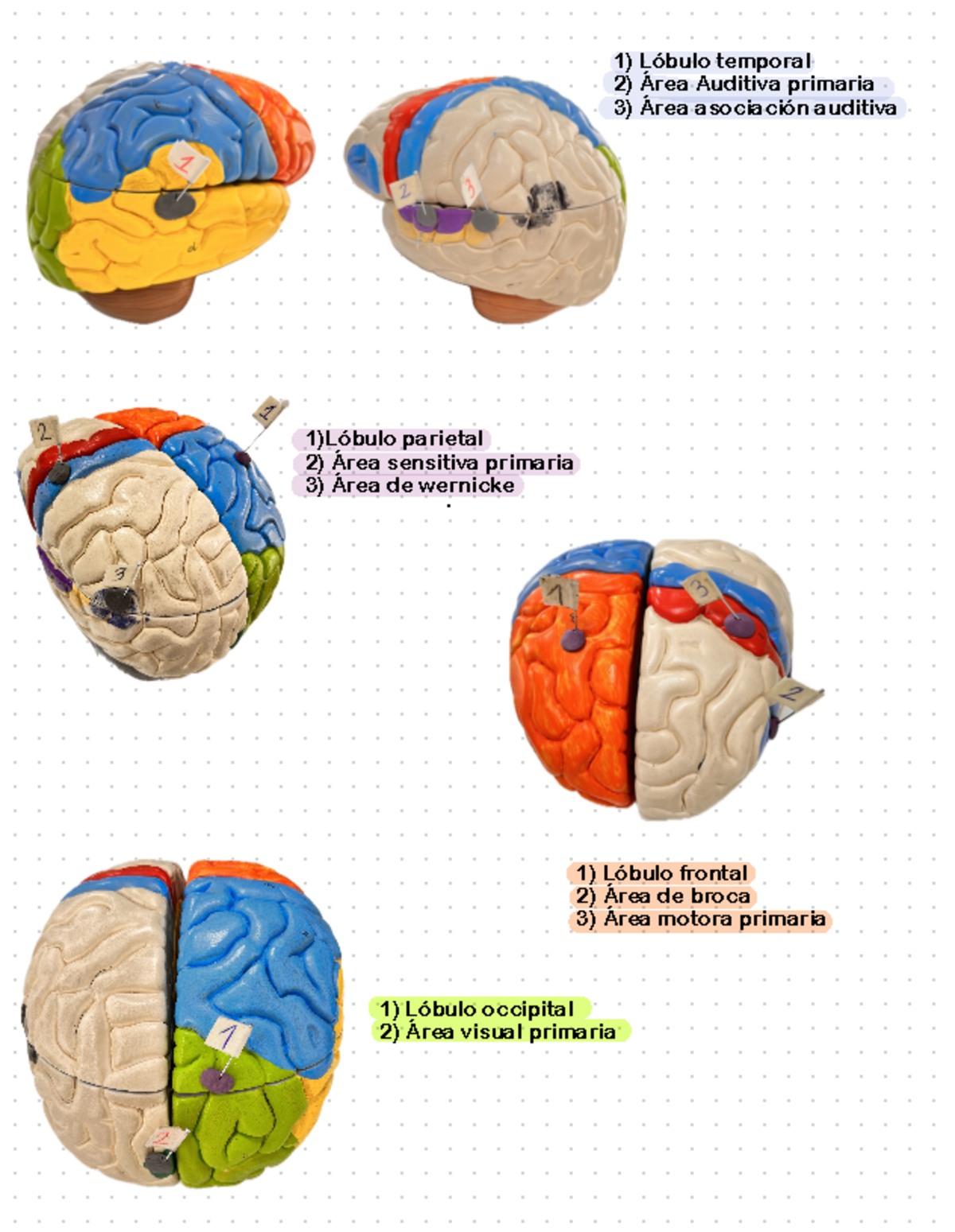 1709695108540 Rótulos Lóbulos-Bulbo - Anatomia Humana - 1) Lóbulo ...